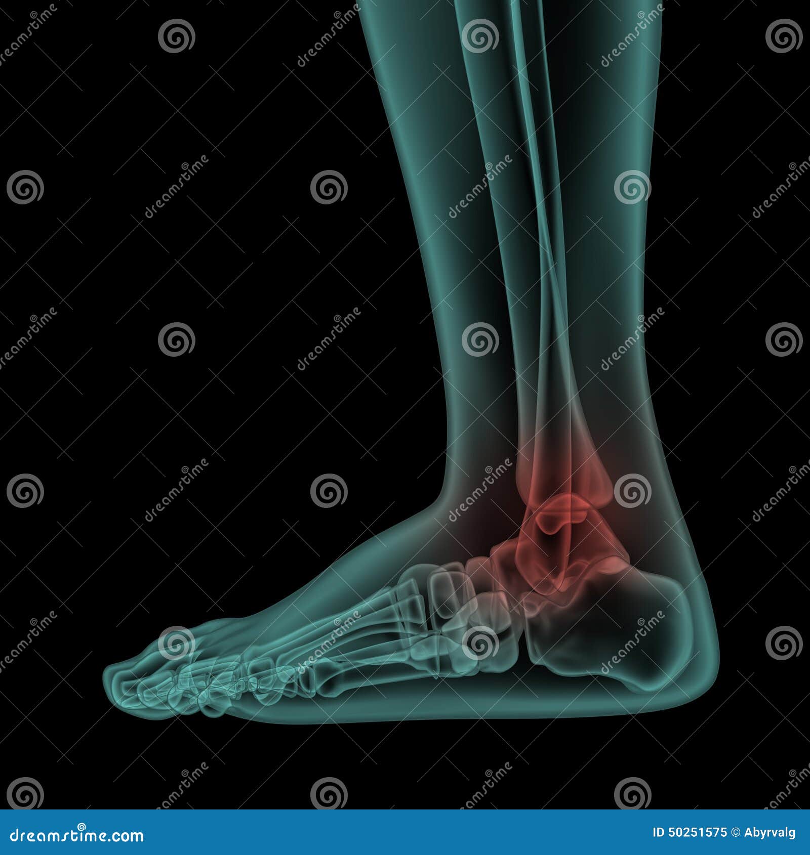Side X-ray View of Human Painful Foot and Ankle Stock Illustration ...