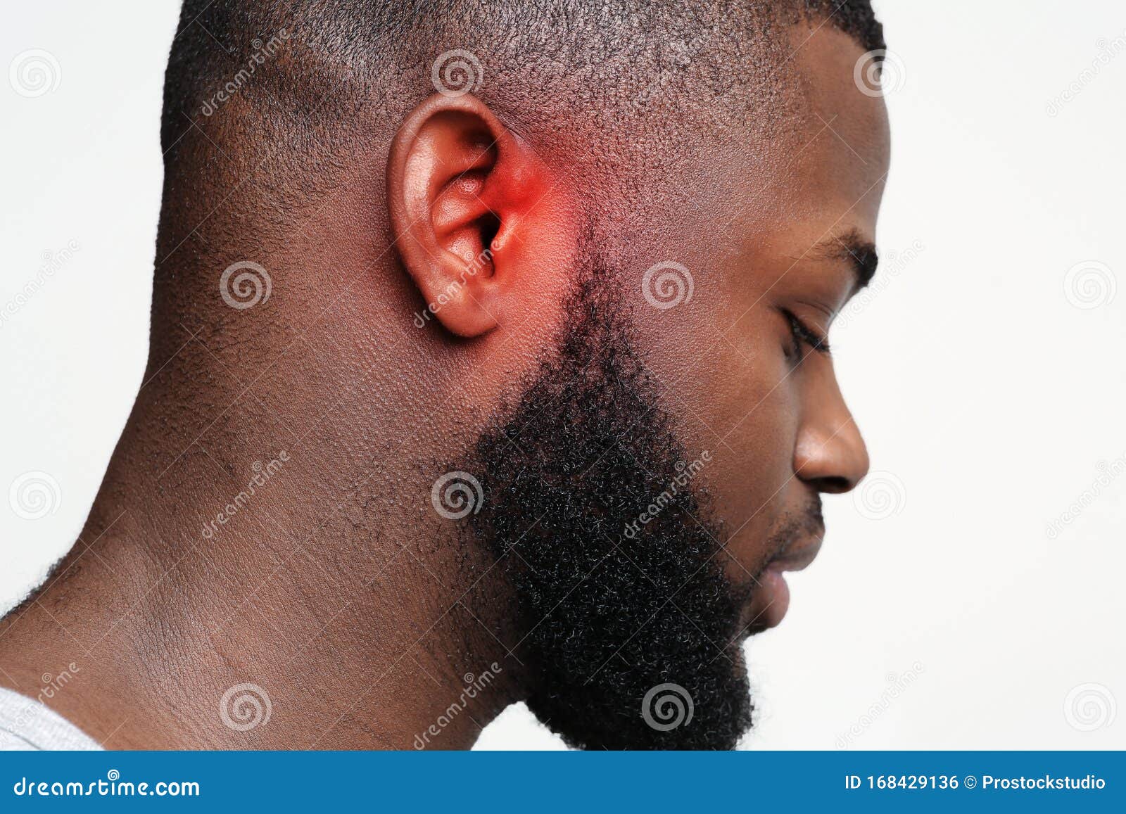 Black Guy with Inflamed Ear, Side View Stock Photo - Image of illness ...