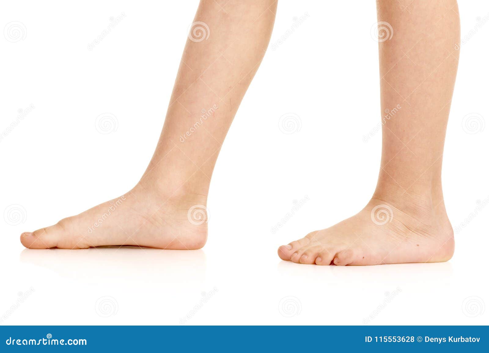 Side-view of barefoot legs stock photo. Image of medical - 115553628