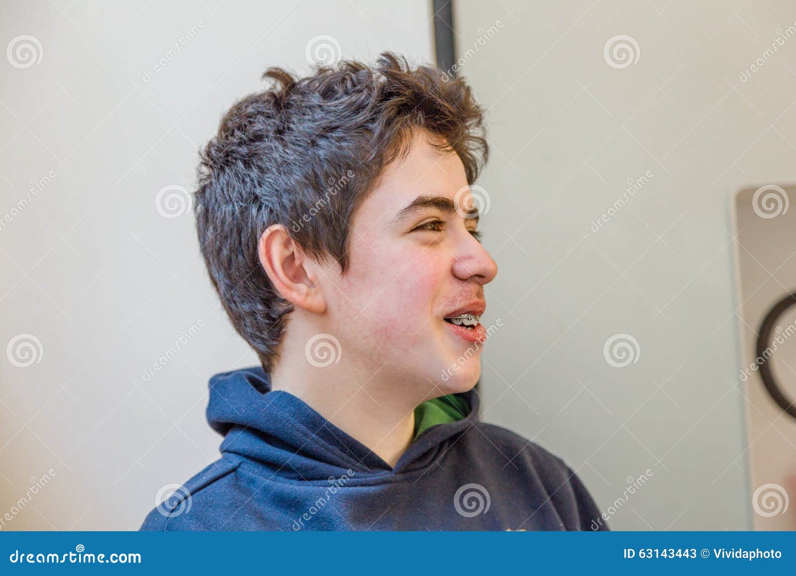 Top View Of Braces Invisible Retainers On A Black Background, New ...