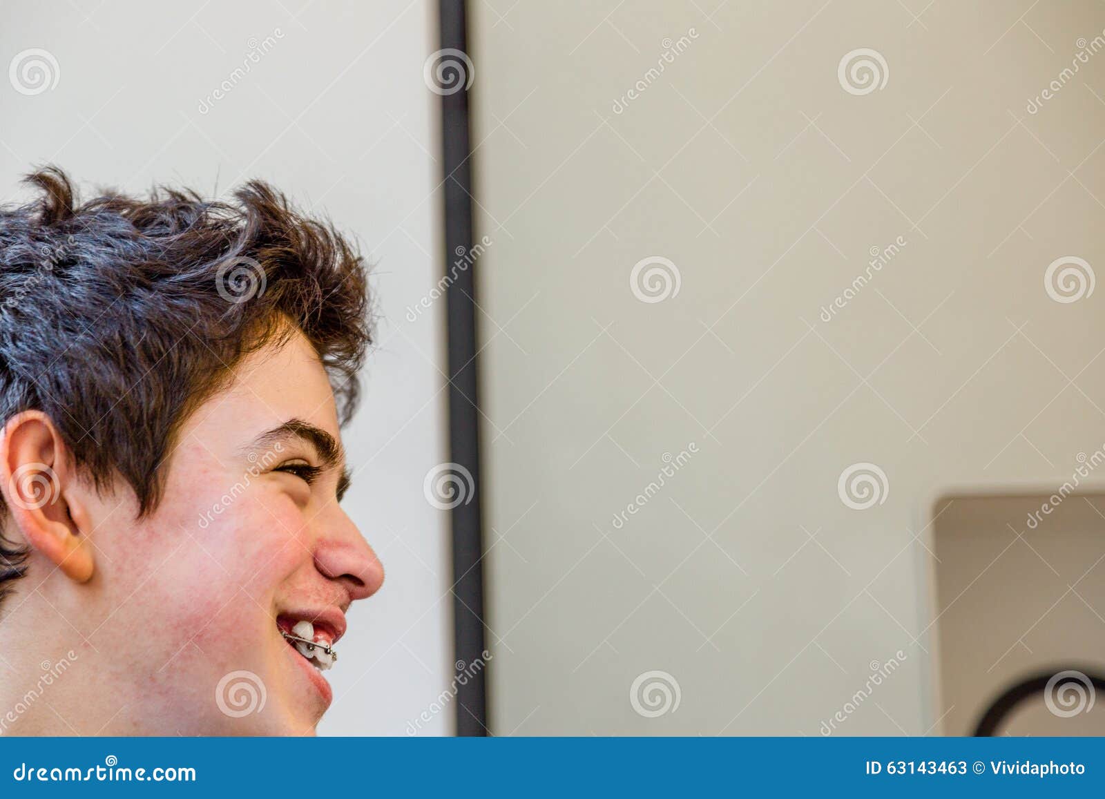 Top View Of Braces Invisible Retainers On A Black Background, New ...