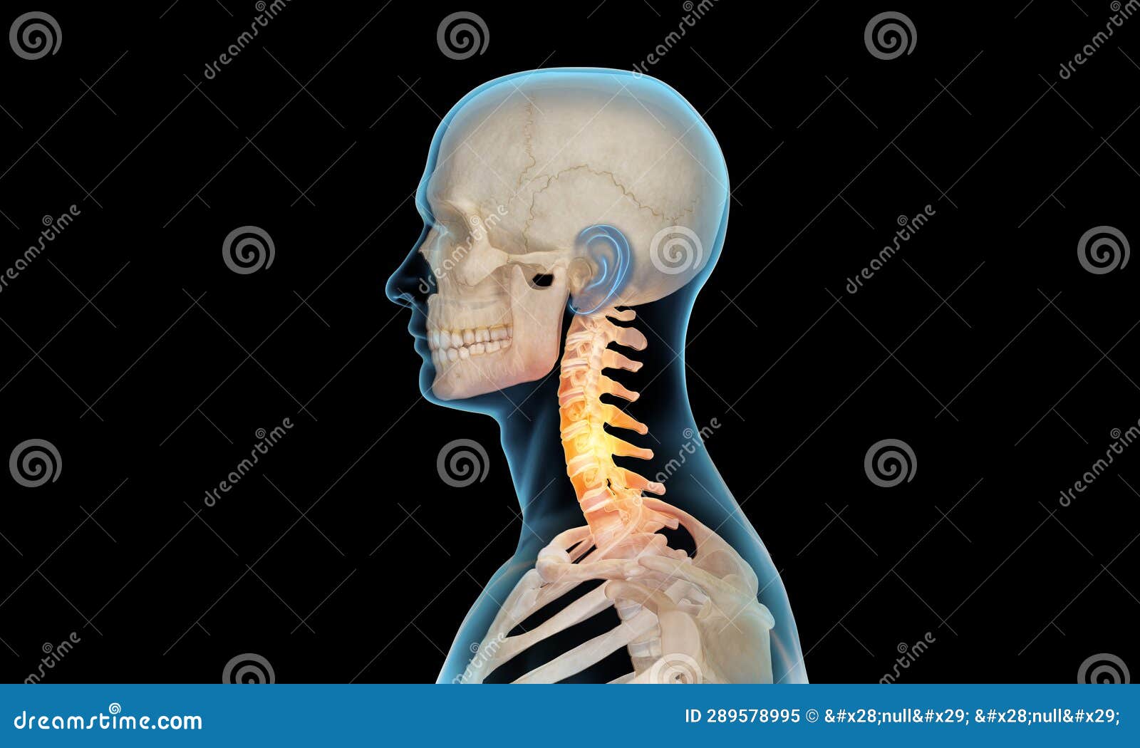 X Ray of Cervical Section of the Spine Stock Illustration ...