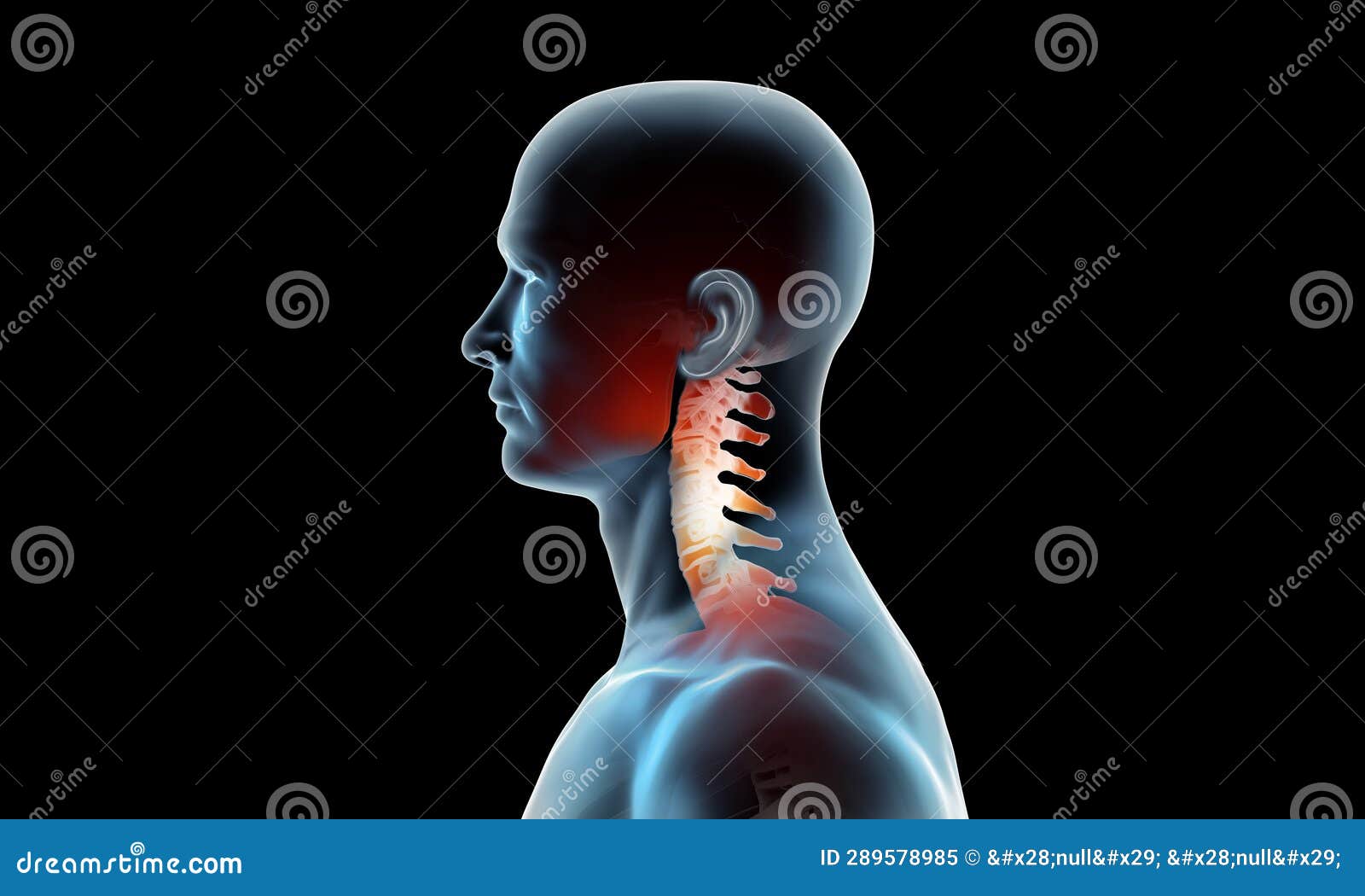 X Ray Of Cervical Section Of The Spine Royalty-Free Stock Image ...