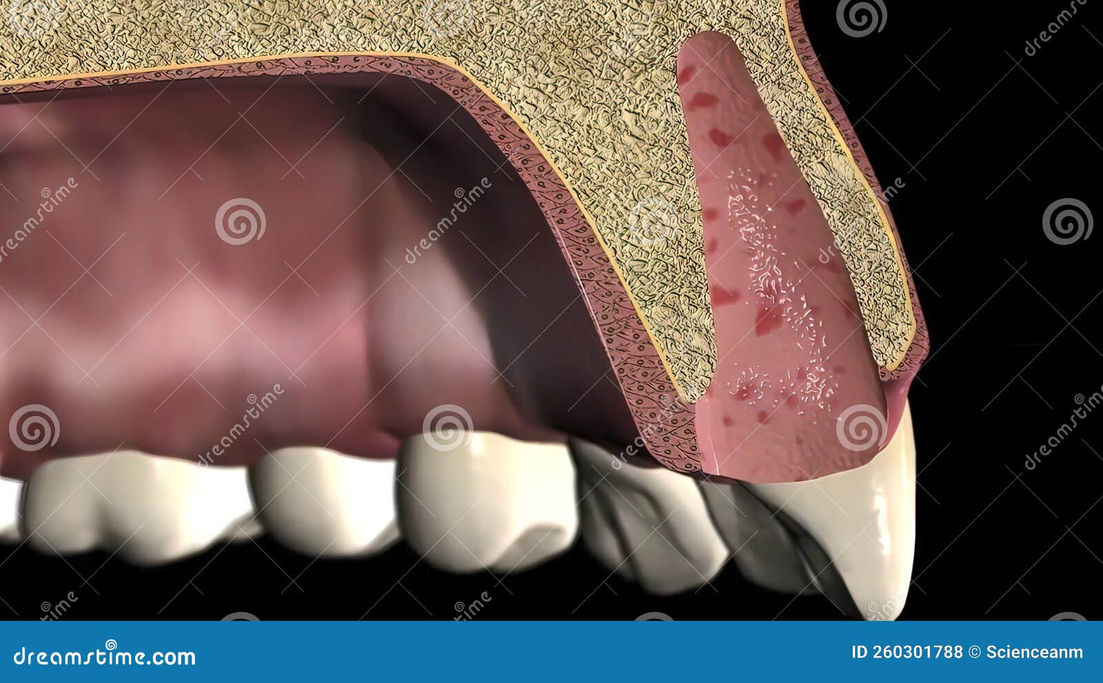 Side View of the Extracted Tooth Stock Illustration - Illustration of ...