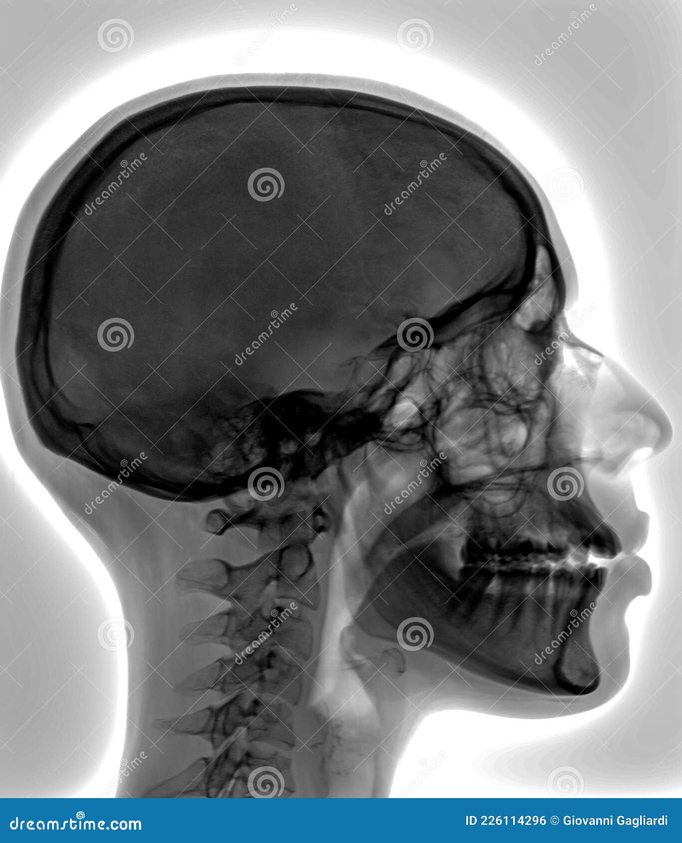 Side View of Human Brain X-ray Medical Scan Stock Photo - Image of ...