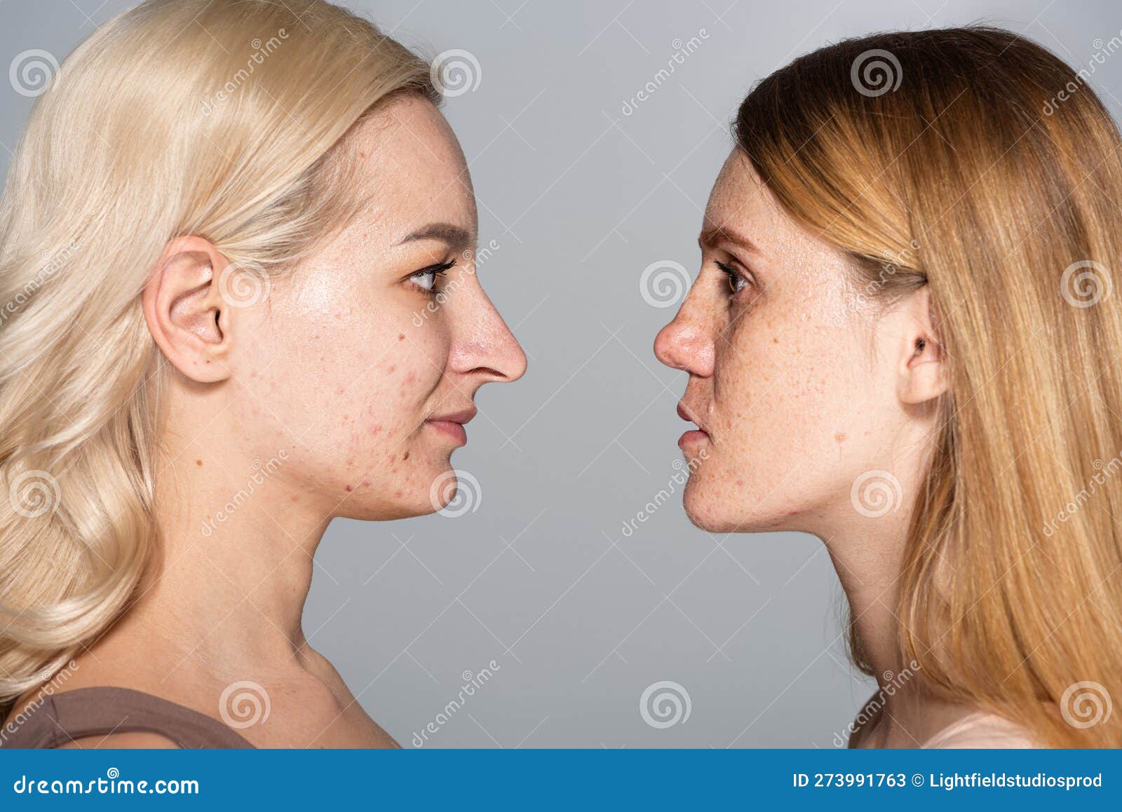 Side View of Models with Problem Stock Image - Image of friends ...