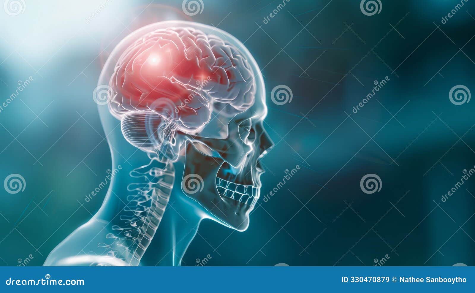 Side View X-ray of Brain with Migraine Stock Illustration ...