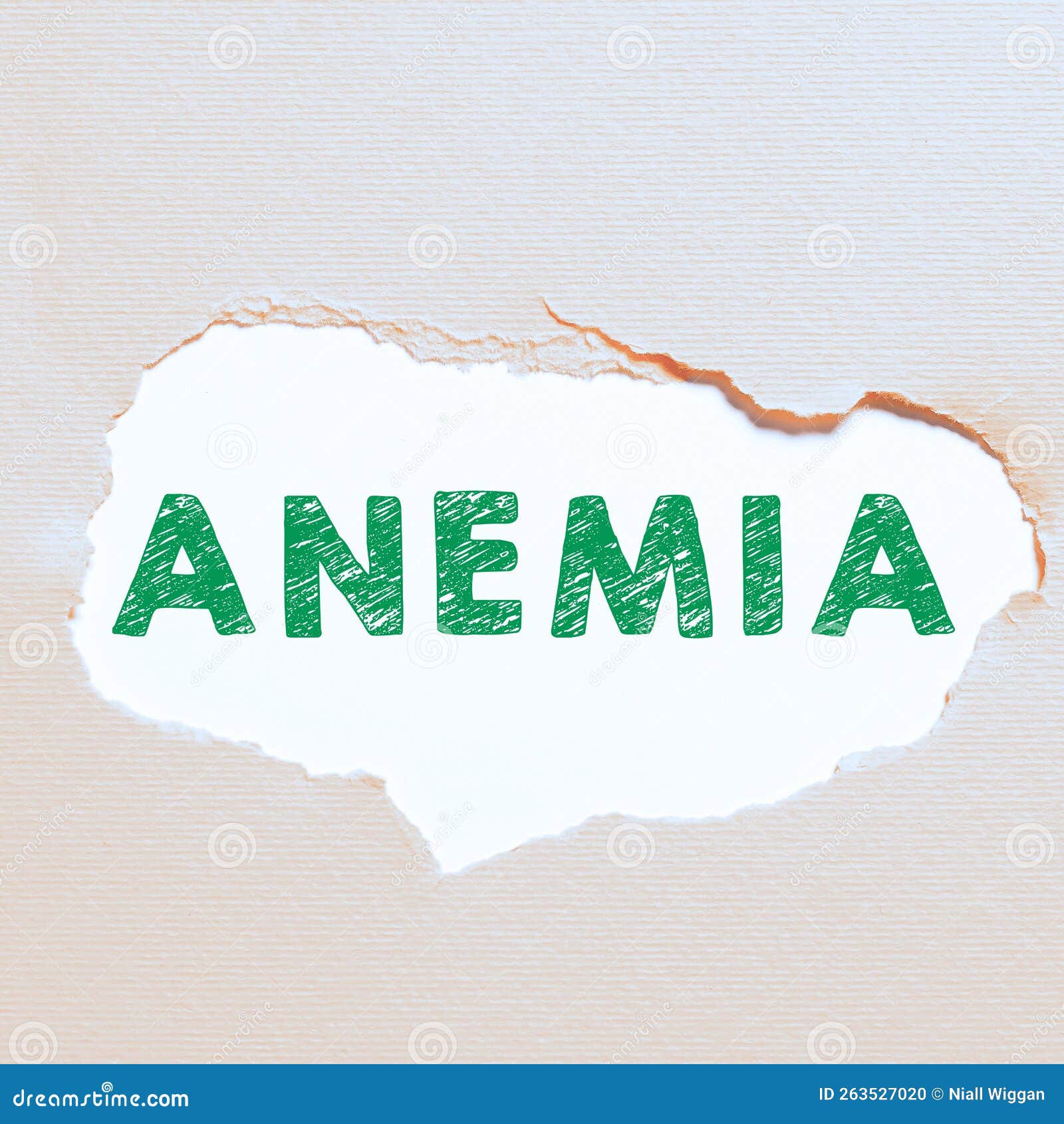 Conceptual Display Anemia. Business Approach Condition Where There ... Conceptual Display Anemia. Business Approach Condition Where There ...