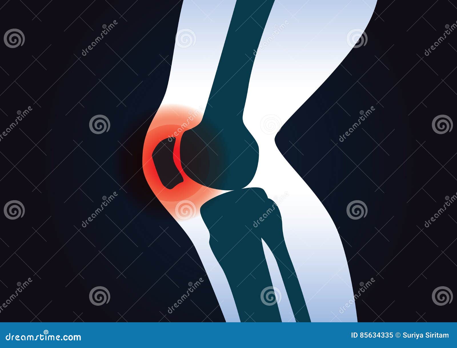 Signal Rouge Au Secteur De Genou Illustration de Vecteur - Illustration ...