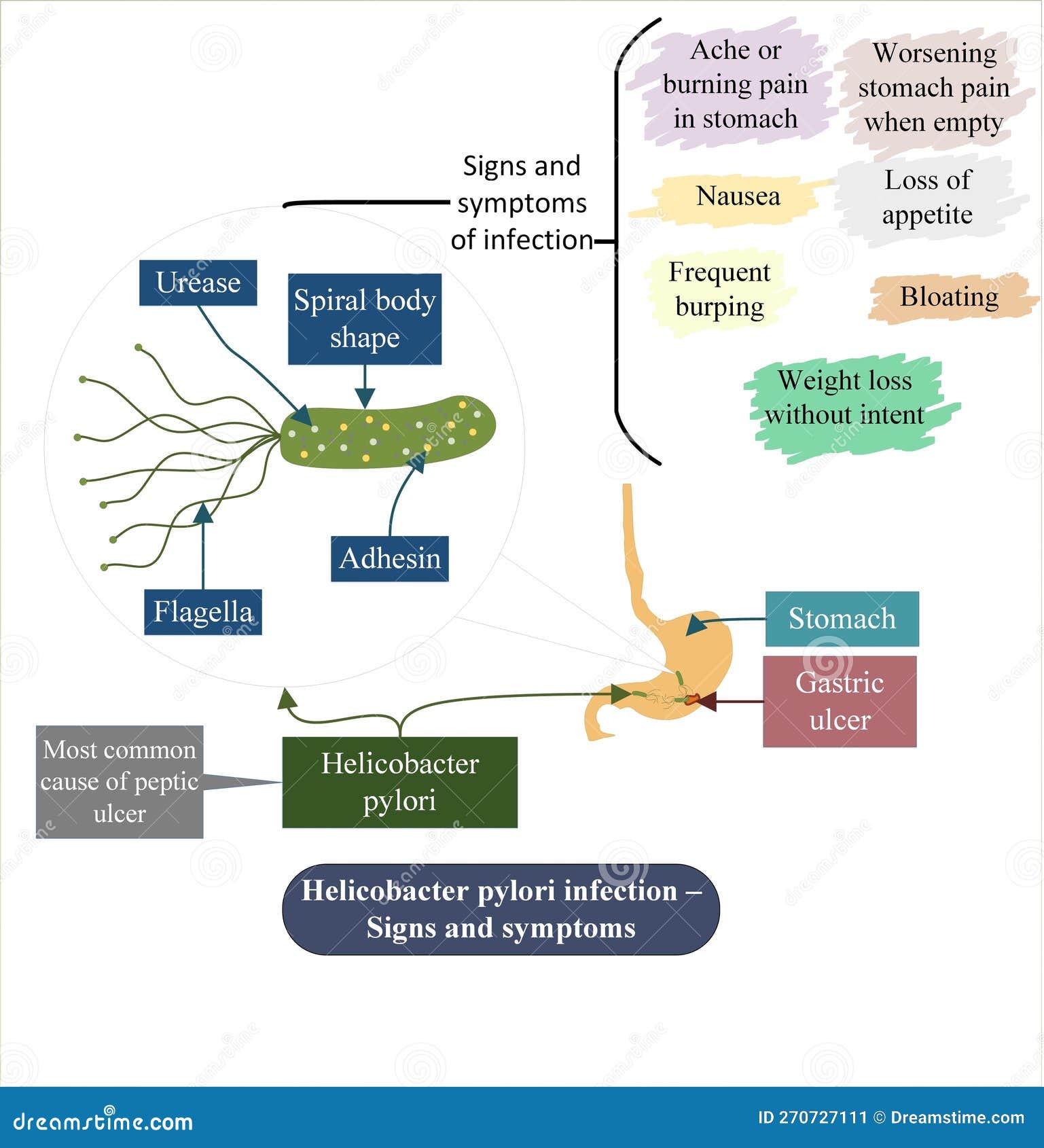 Signs and Symptoms Associated with Helicobacter Pylori Infection Stock ...