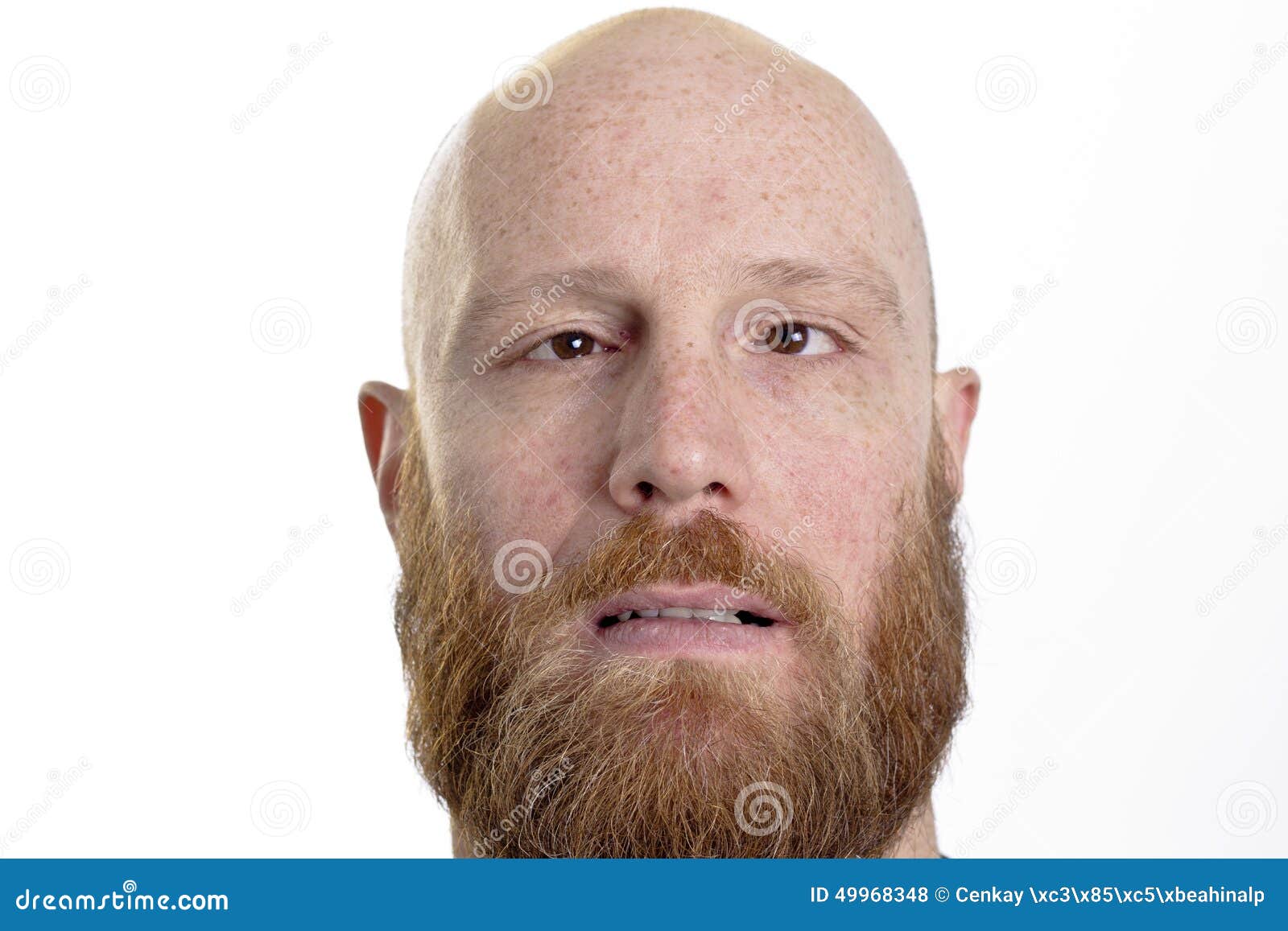 Silly Bald Man with Red Beard and Crossed Eyes Stock Photo - Image of ... Silly Bald Man with Red Beard and Crossed Eyes Stock Photo - Image of ...