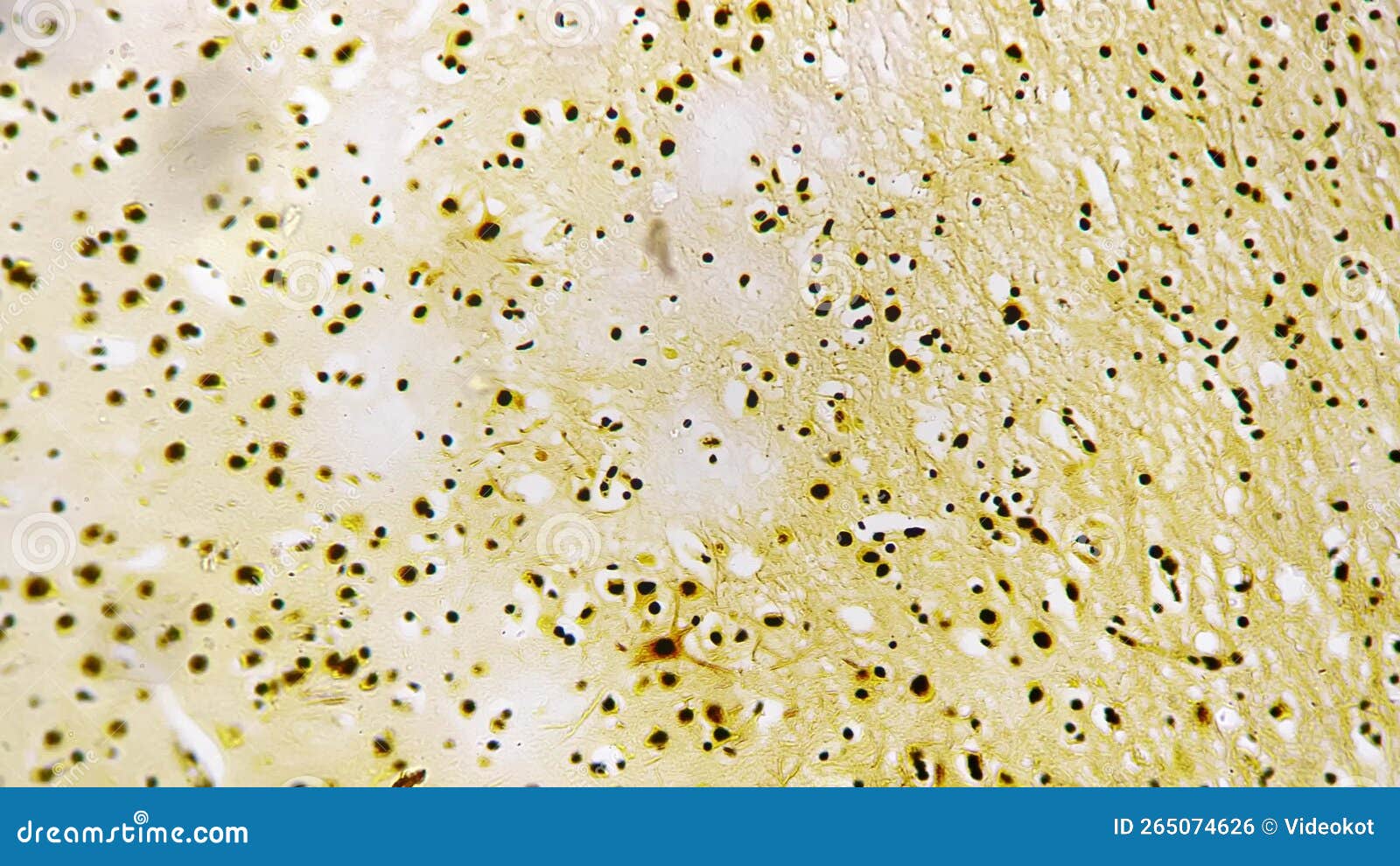 Silvering Cerebrum in Section of Human Being Filmed Under Microscope ...