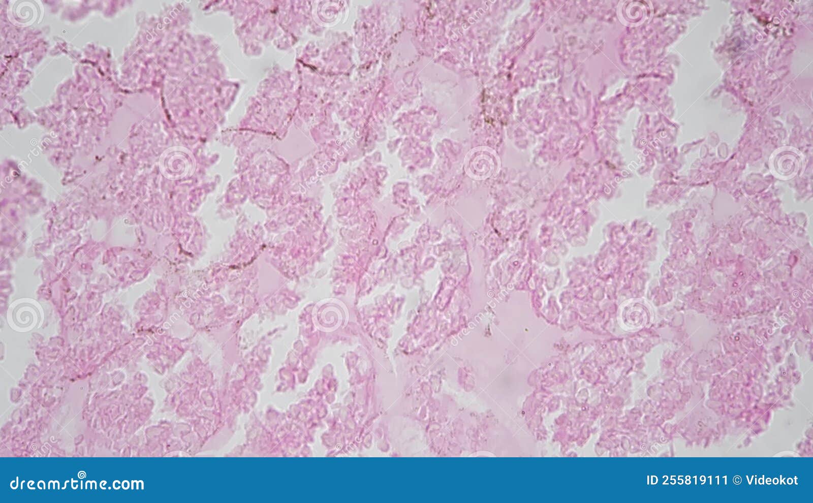 Simple-cell of Egg of Frog Filmed in Static Under Microscope with 400x ...