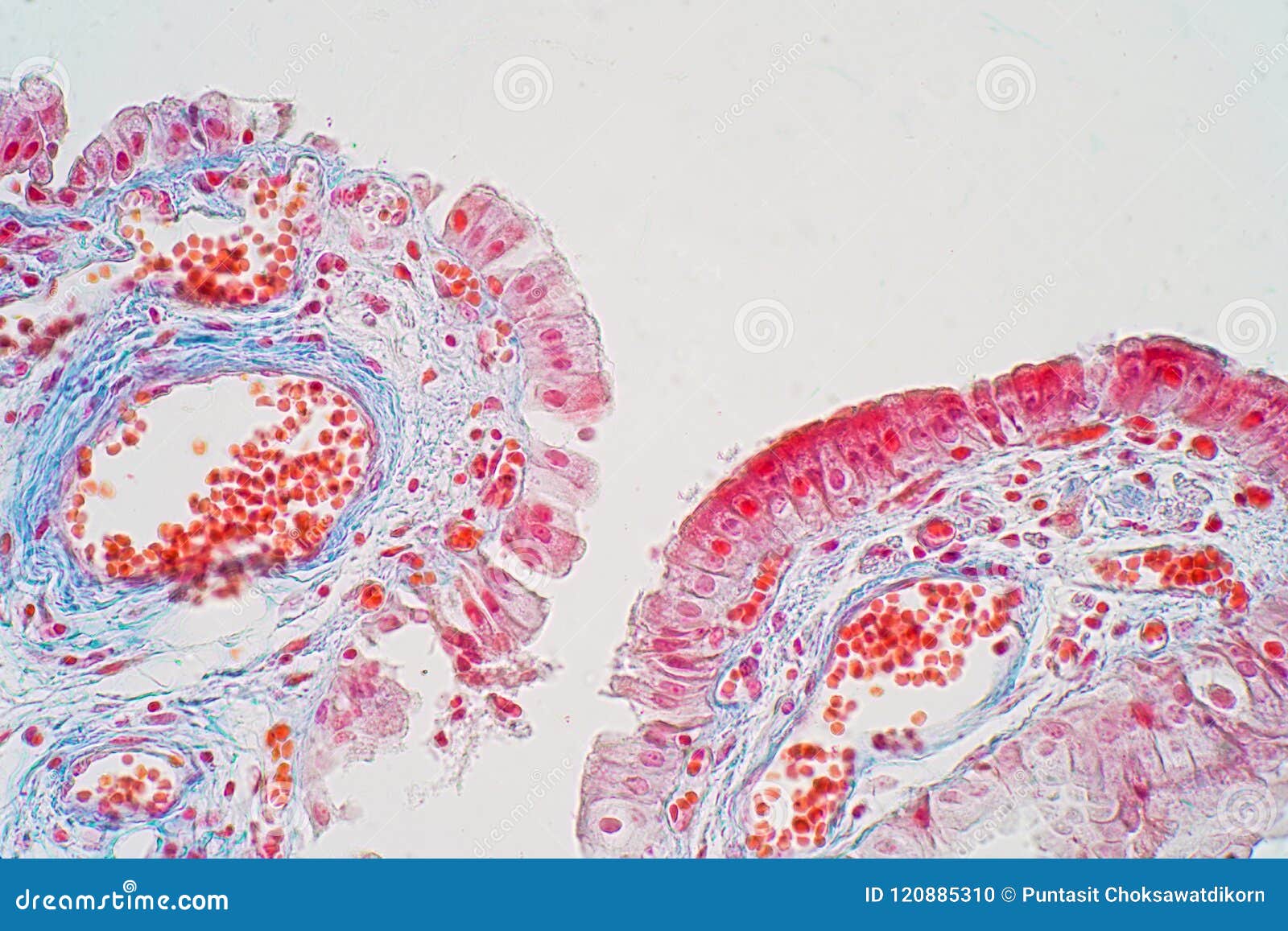 Simple Columnar Epithelium is a Columnar Epithelium that is Uni-layered ...