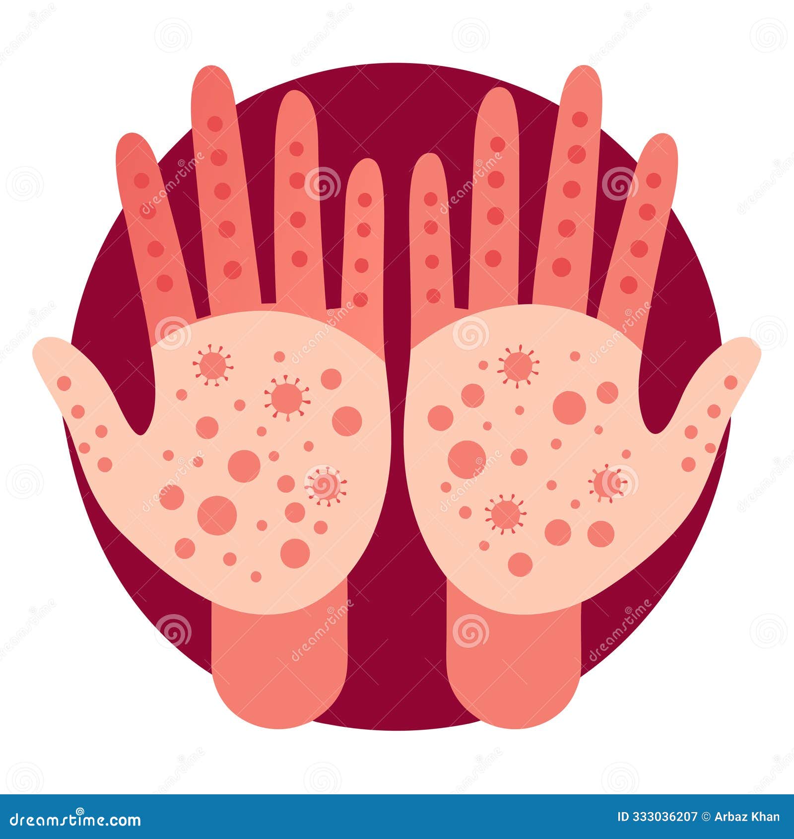 Red Rash On Hands. Allergy, Dermatitis, Psoriasis Or Eczema. Hands ...