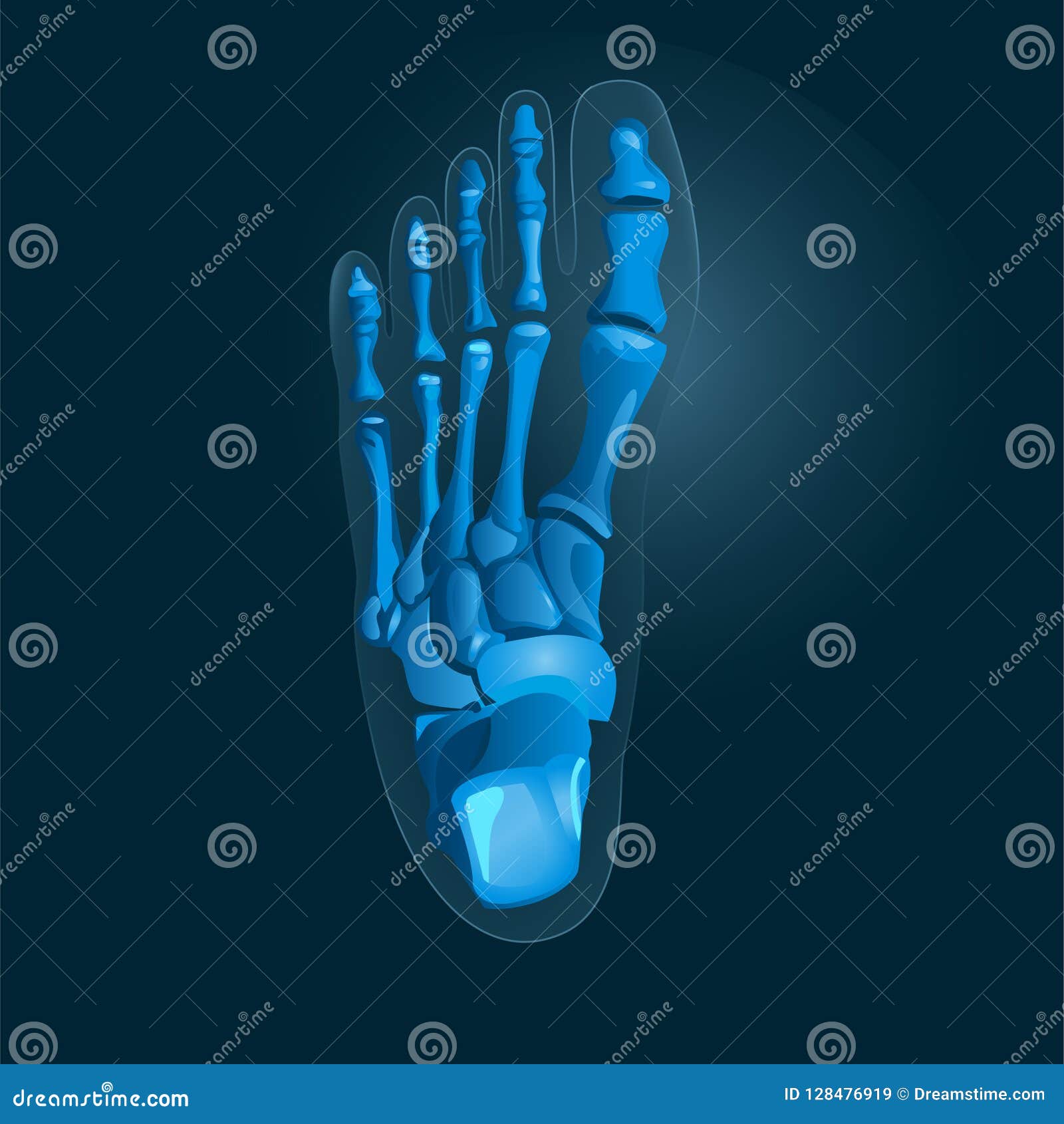 Simple X-ray Picture of Foot in Blue Colors. Vector. X-ray Foot Icon ...