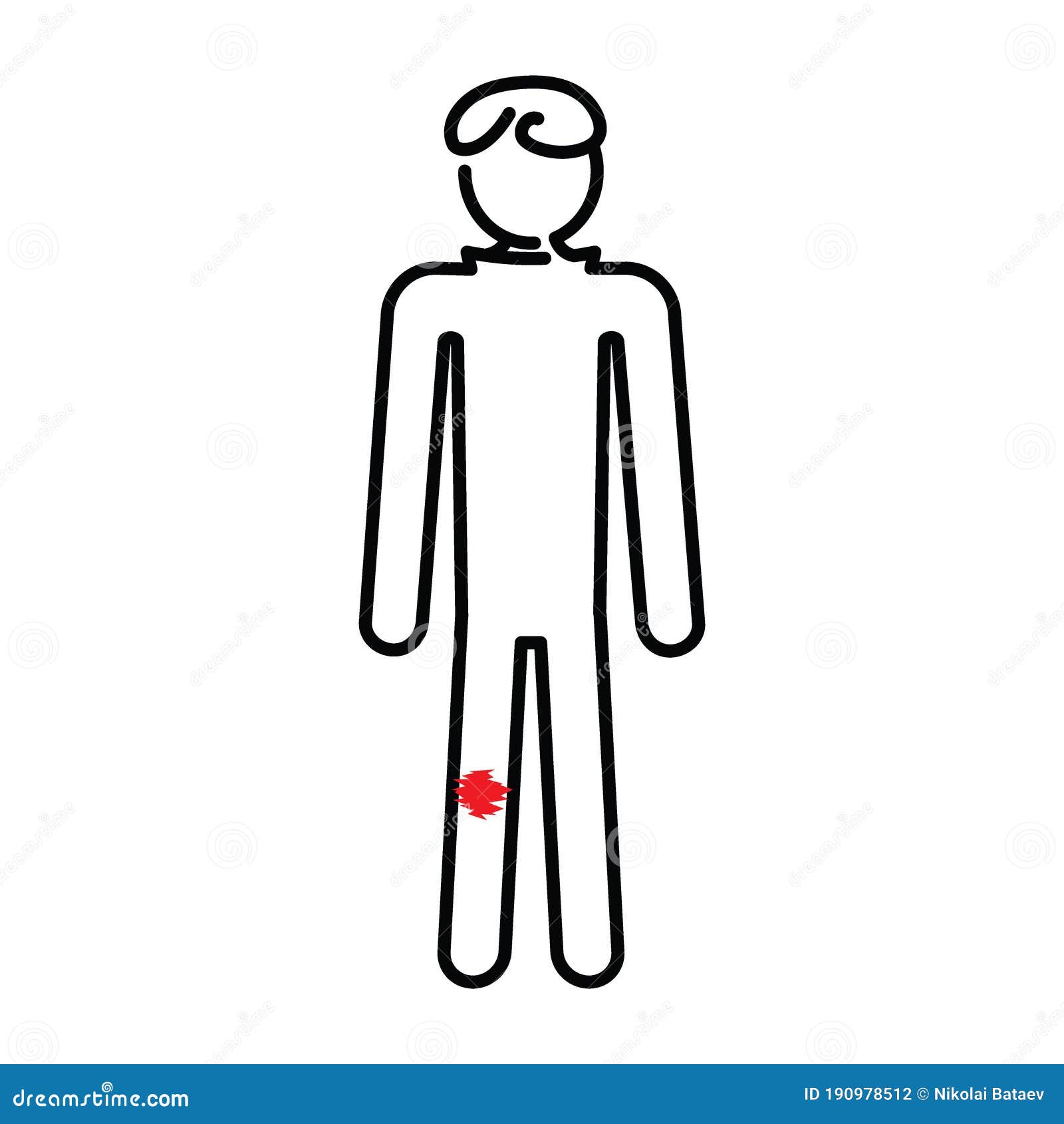 Simple Stylized Vector Image of a Man with Knee Problems. Stock Vector ...