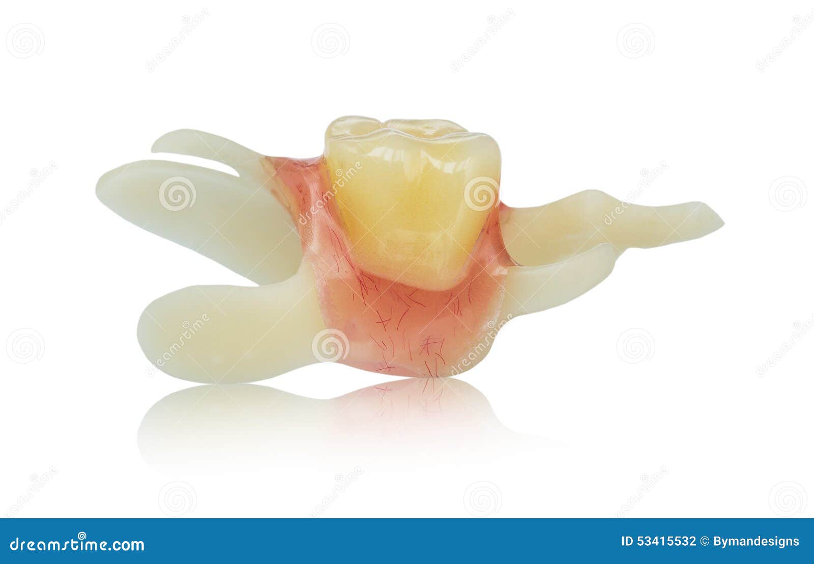 Artificial Denture Royalty-Free Stock Photo | CartoonDealer.com #2216997