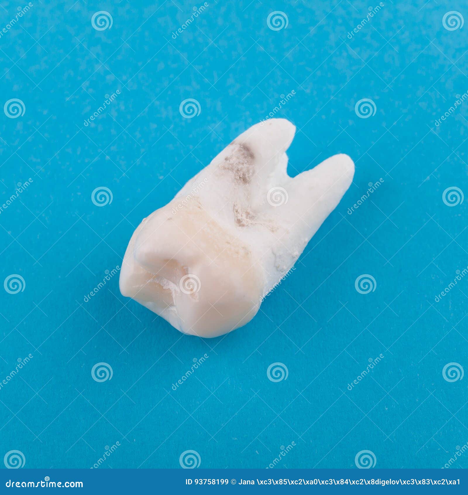 Single Extracted Decayed Tooth on Blue Background Stock Image - Image ...
