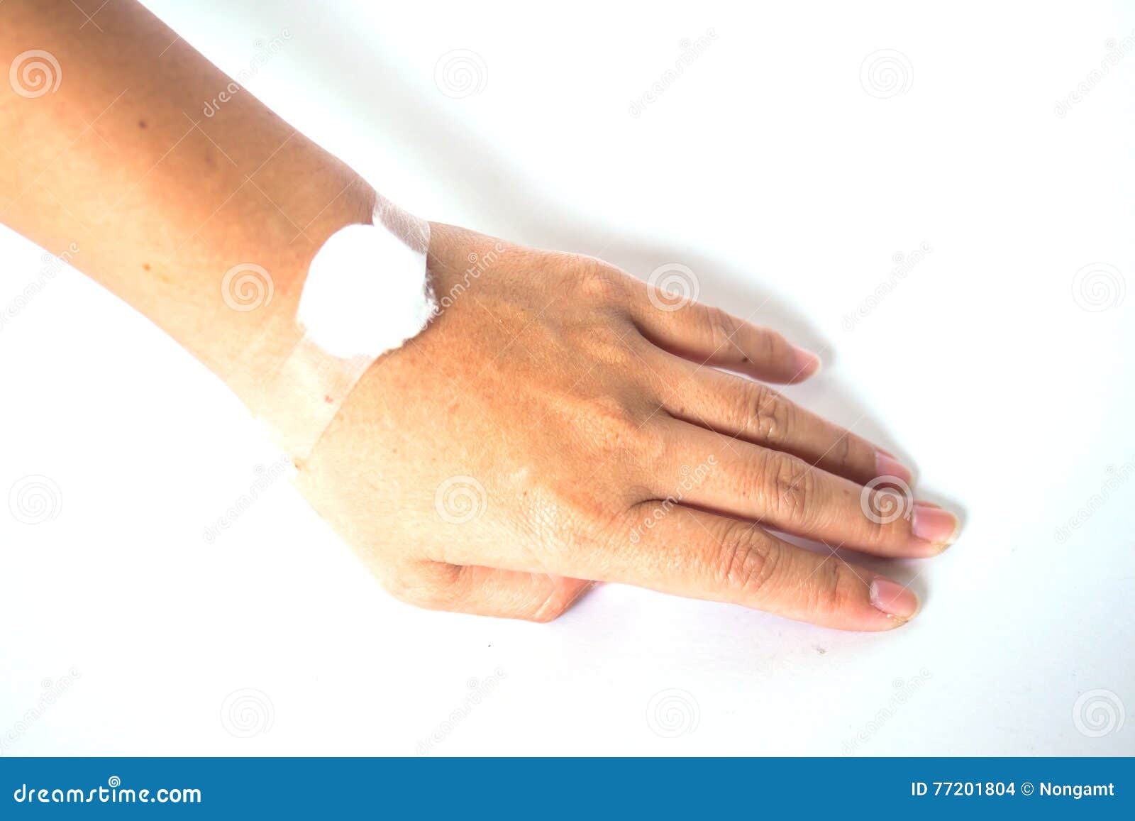Single Hand Drip Receiving a Saline Solution Stock Photo - Image of ...