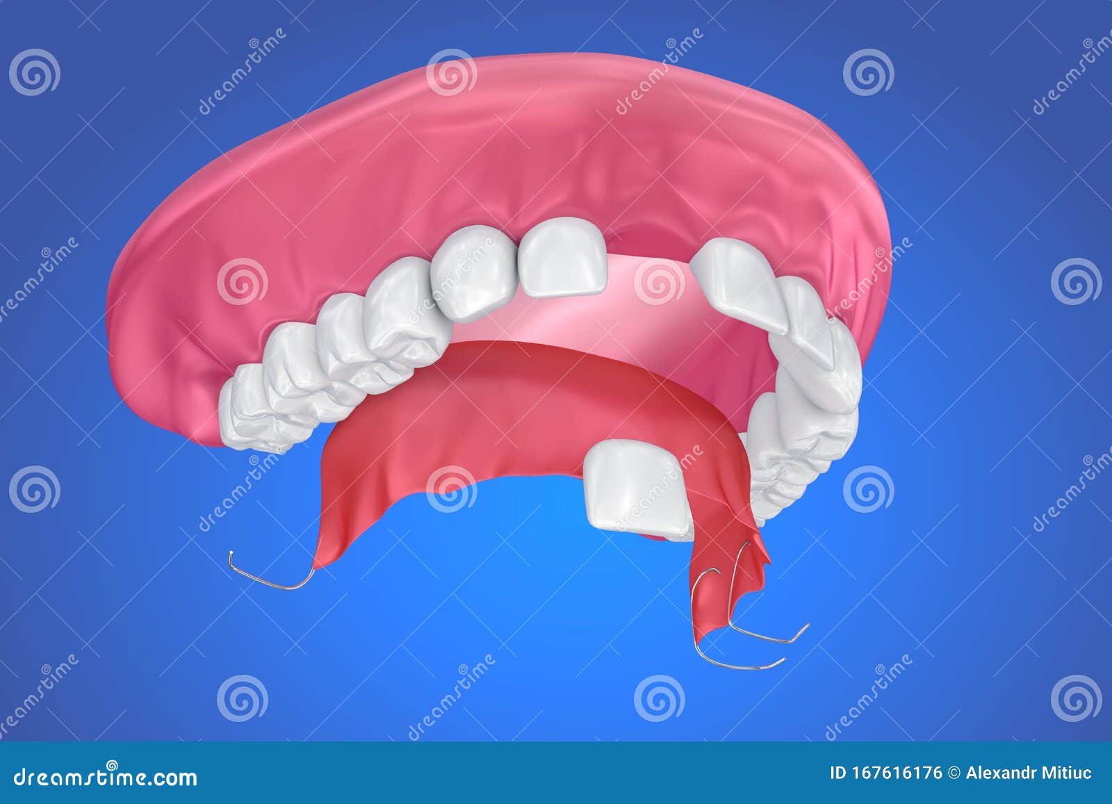 Partial Denture Linear Icon. Modern Outline Partial Denture Logo Vector ...