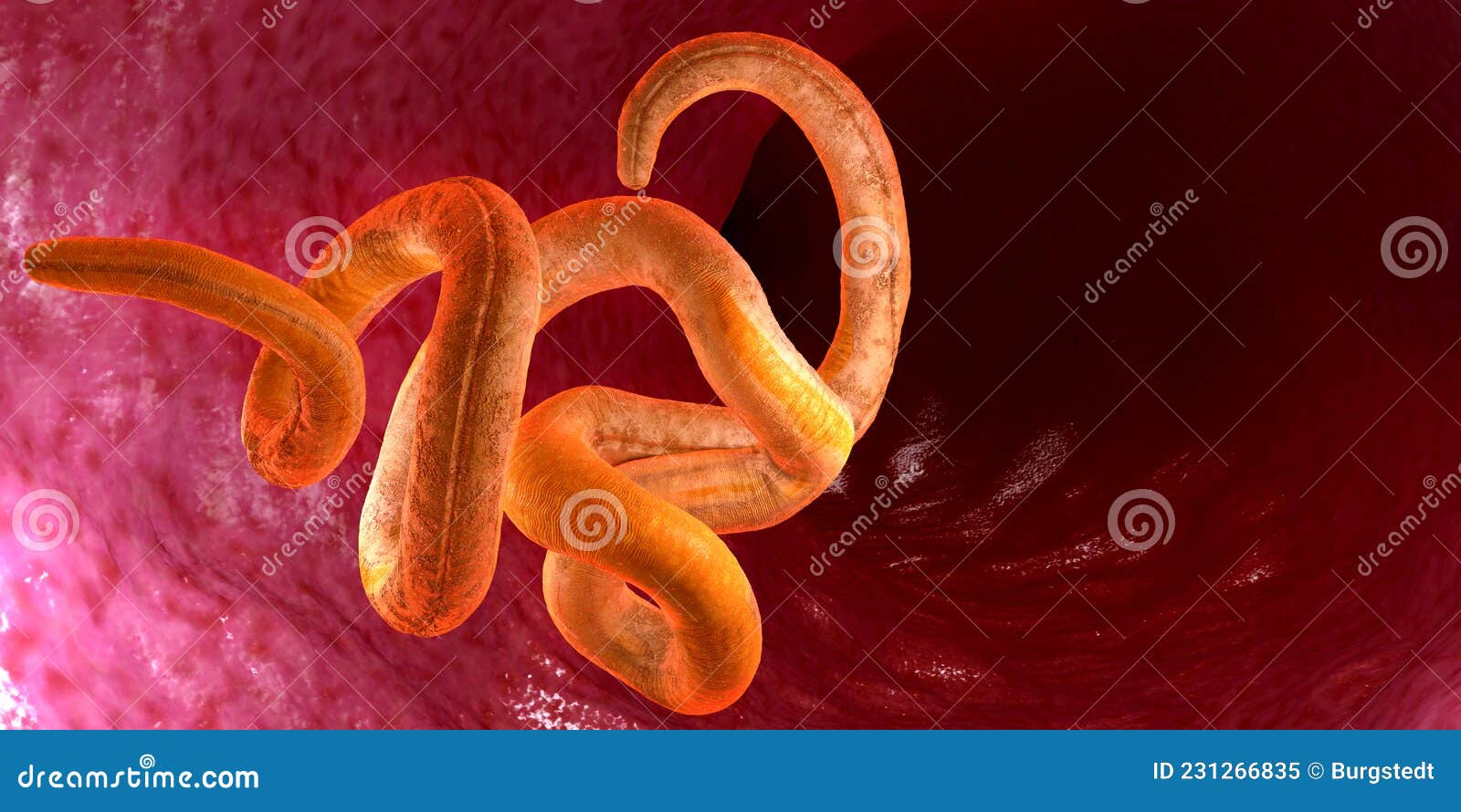 Single Twisted Nematode On A Black Background Royalty-Free Cartoon ...