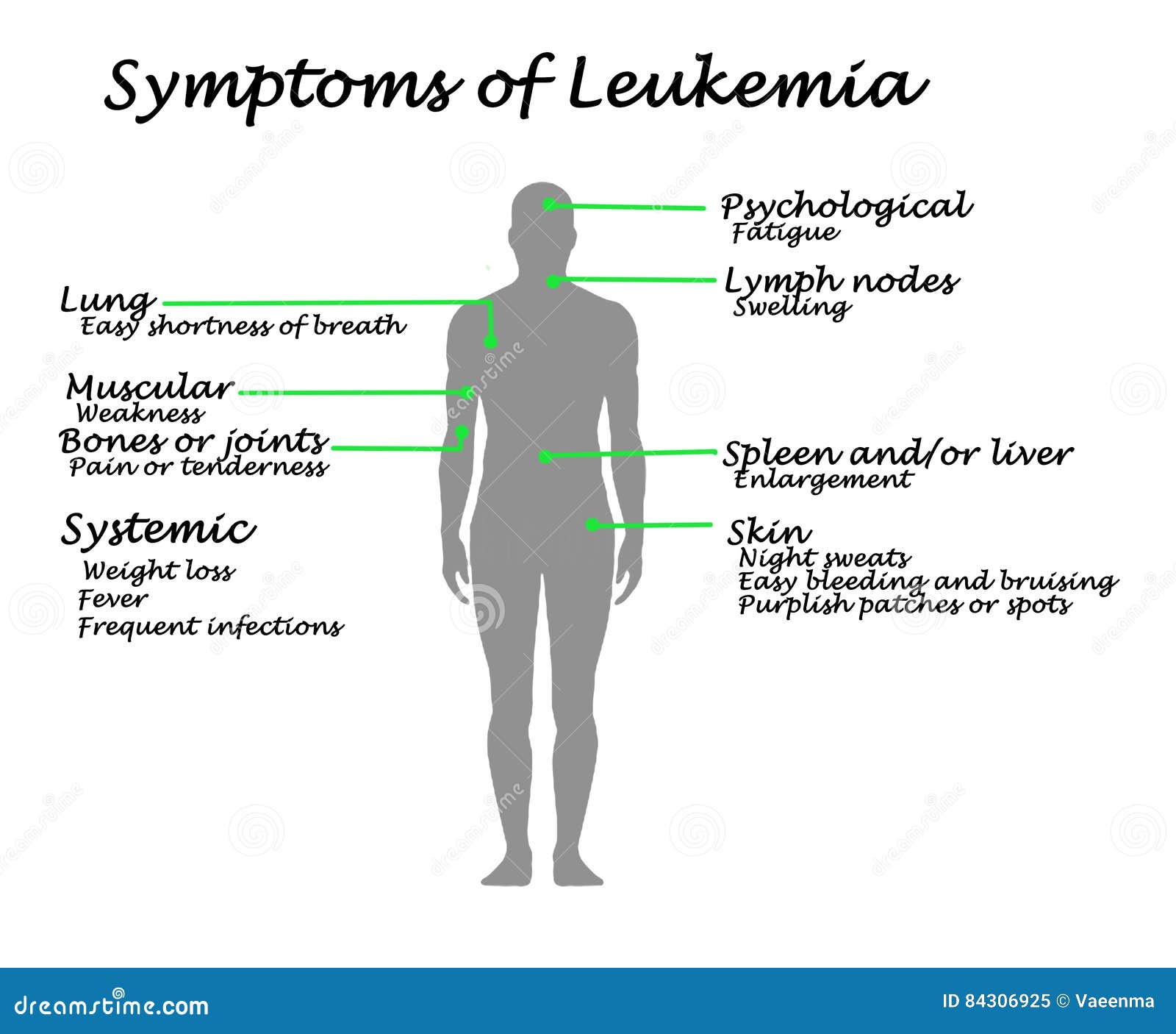 Sintomas Comuns Da Leucemia Ilustração Stock - Ilustração de ...