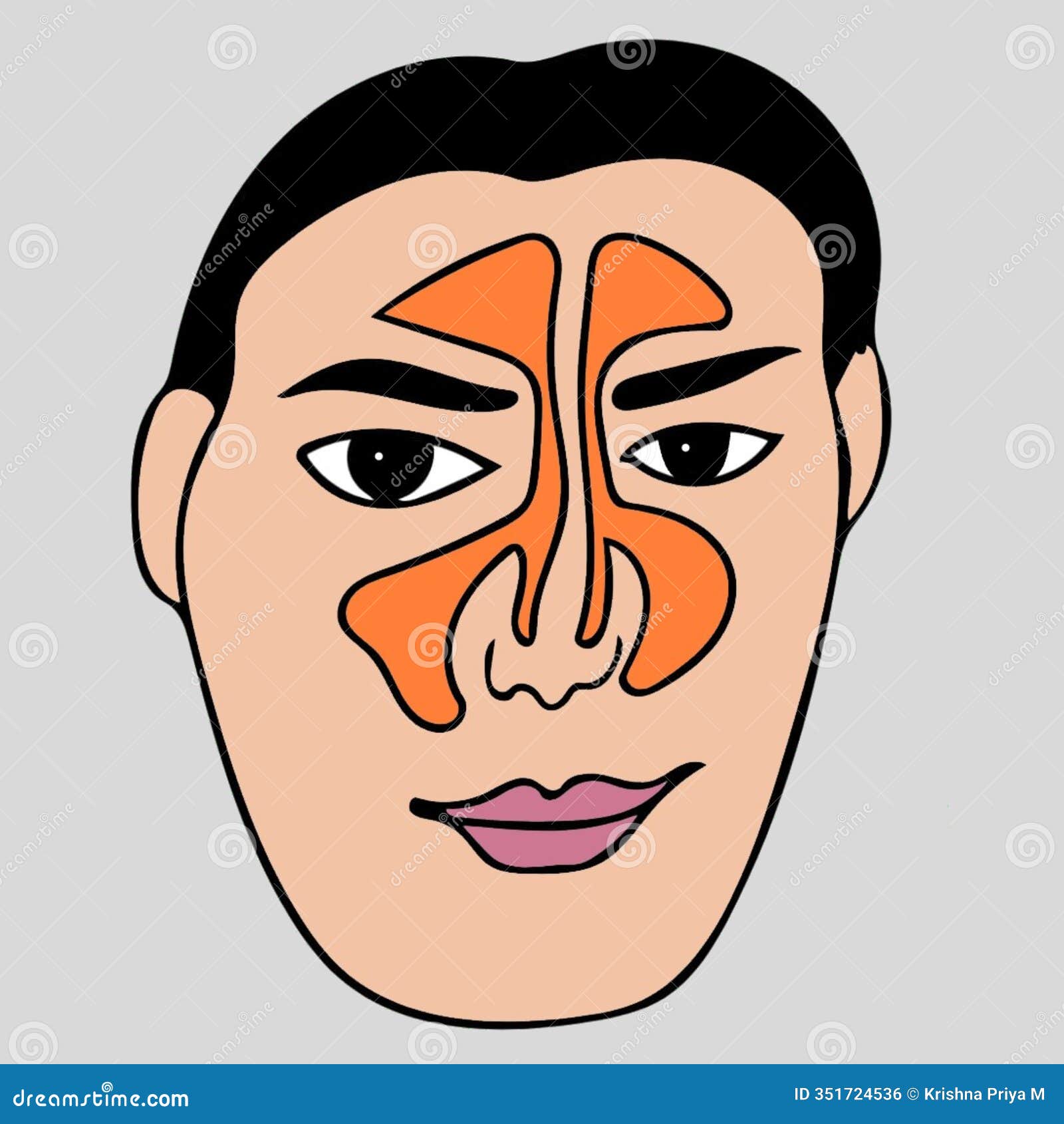 Sinusitis Infected Areas Face Illustration Stock Illustration ...