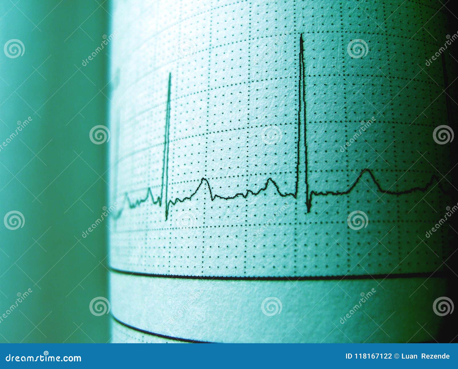 Sinus Heart Rhythm on Electrocardiogram Record Paper Stock Photo ... Sinus Heart Rhythm on Electrocardiogram Record Paper Stock Photo ...