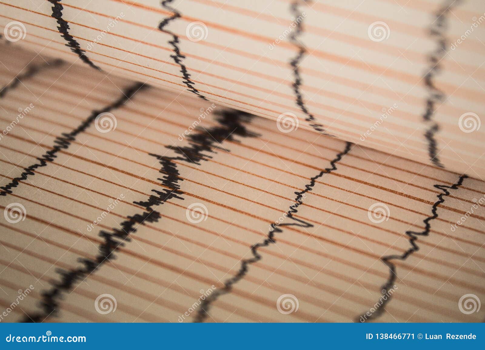 Sinus Heart Rhythm on Electrocardiogram Record Paper Showing Normal P ... Sinus Heart Rhythm on Electrocardiogram Record Paper Showing Normal P ...