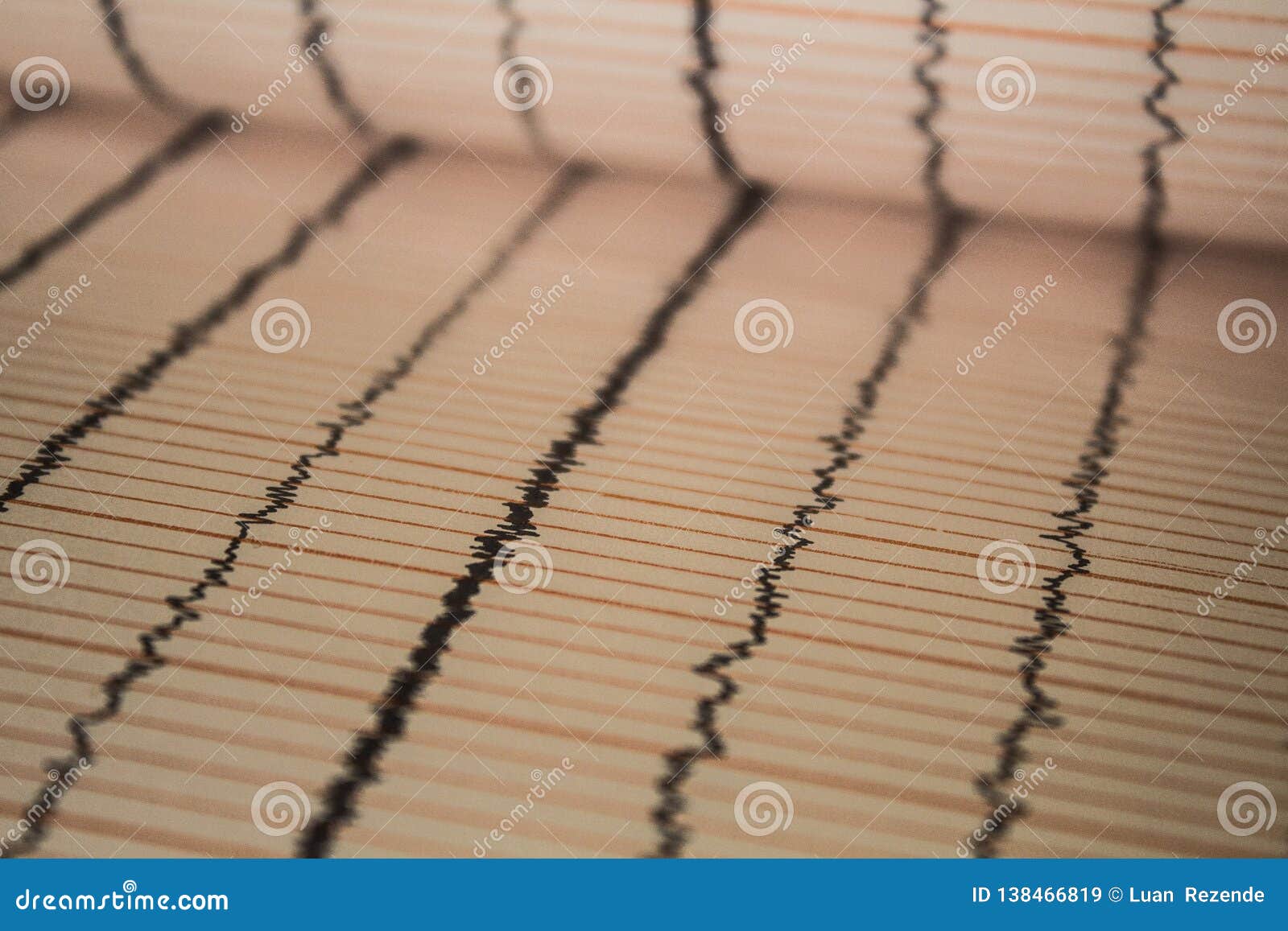 Sinus Heart Rhythm on Electrocardiogram Record Paper Showing Normal P ... Sinus Heart Rhythm on Electrocardiogram Record Paper Showing Normal P ...
