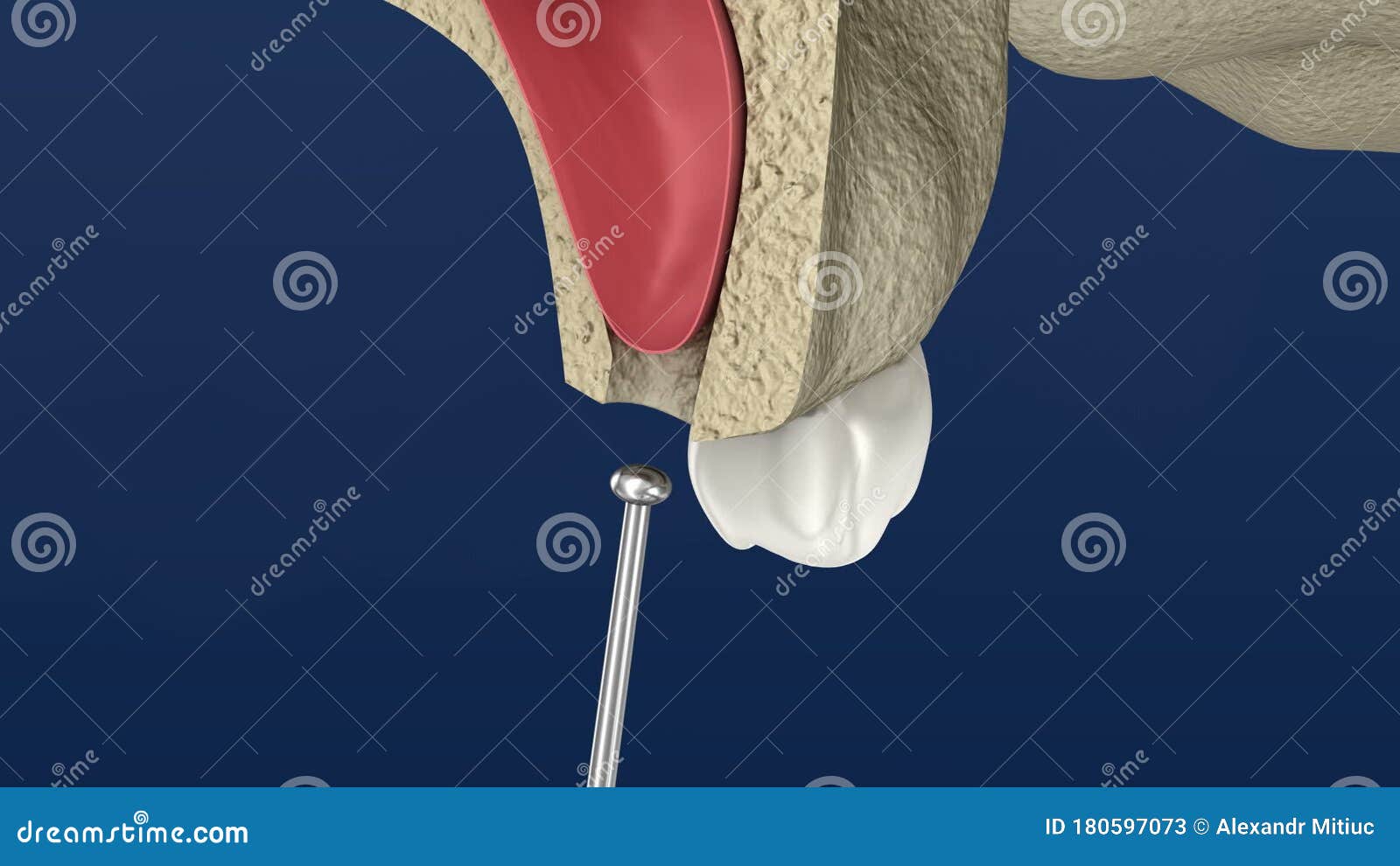 Augmentation Cartoons, Illustrations & Vector Stock Images - 4567 ...