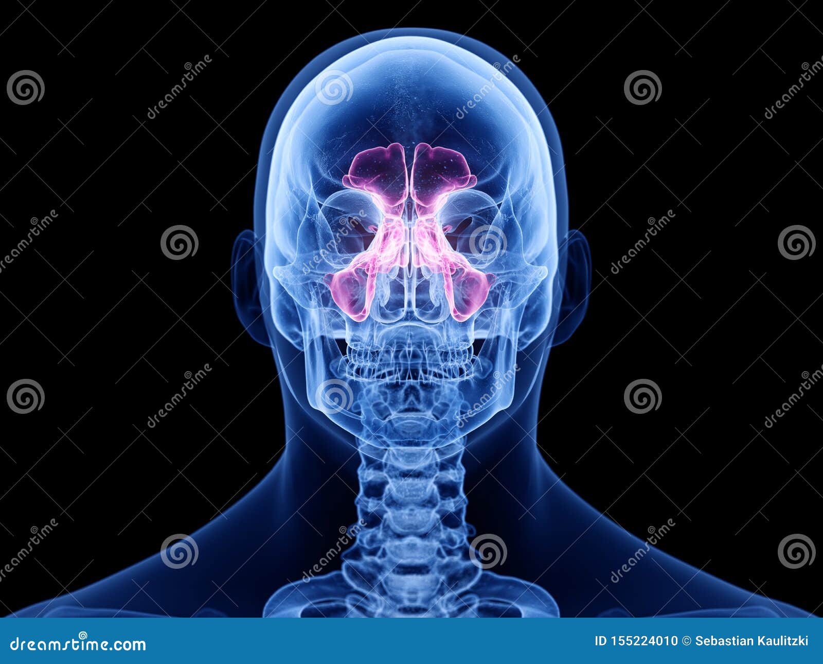 The sinuses stock illustration. Illustration of medically - 155224010