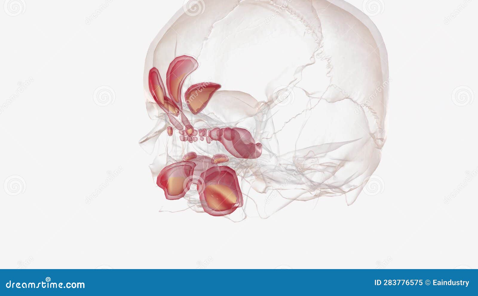 Sinusitis is an Inflammation, or Swelling, of the Tissue Lining Your ...