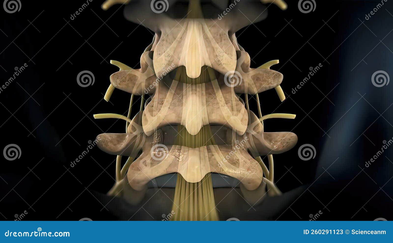 Site of Nerve Compression 3d Medical Stock Illustration - Illustration ...