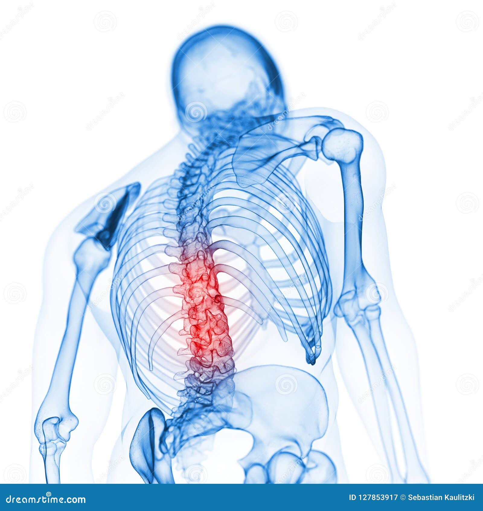 The skeletal back stock illustration. Illustration of disease - 127853917