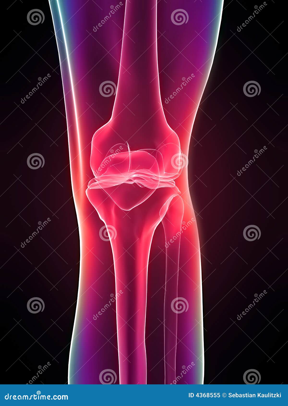 Skeletal knee stock illustration. Illustration of xray - 4368555