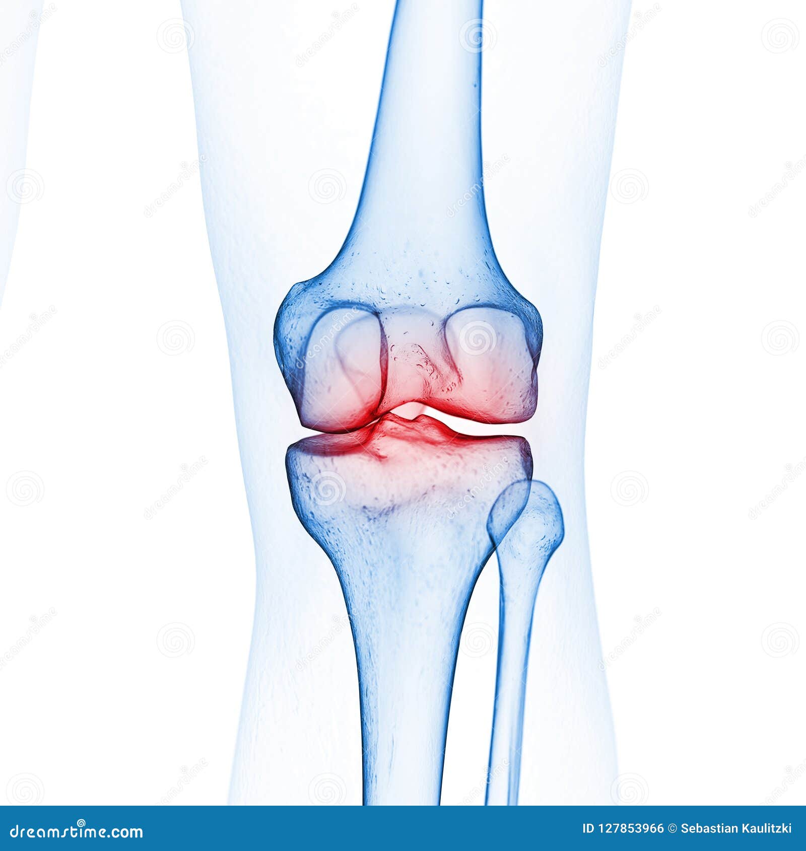 The Skeletal Knee Royalty-Free Cartoon | CartoonDealer.com #127853966