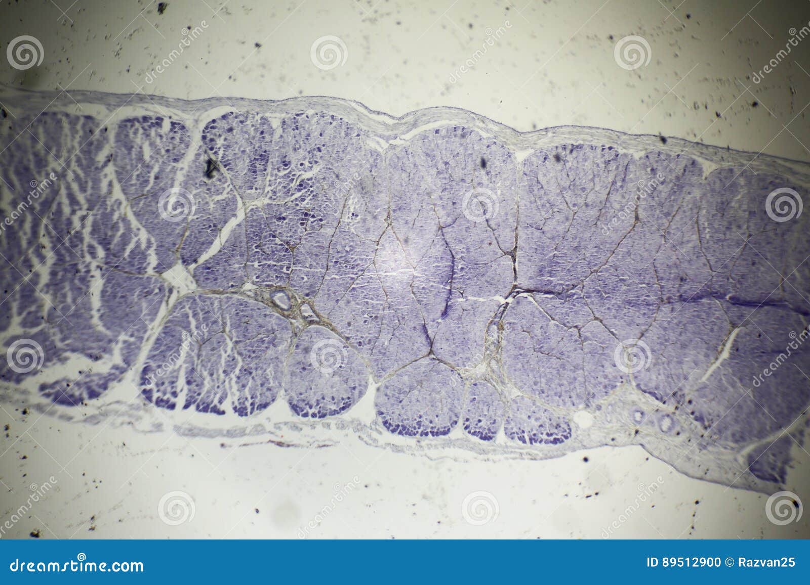 Skeletal Muscle Section Under the Microscope Stock Photo - Image of ...
