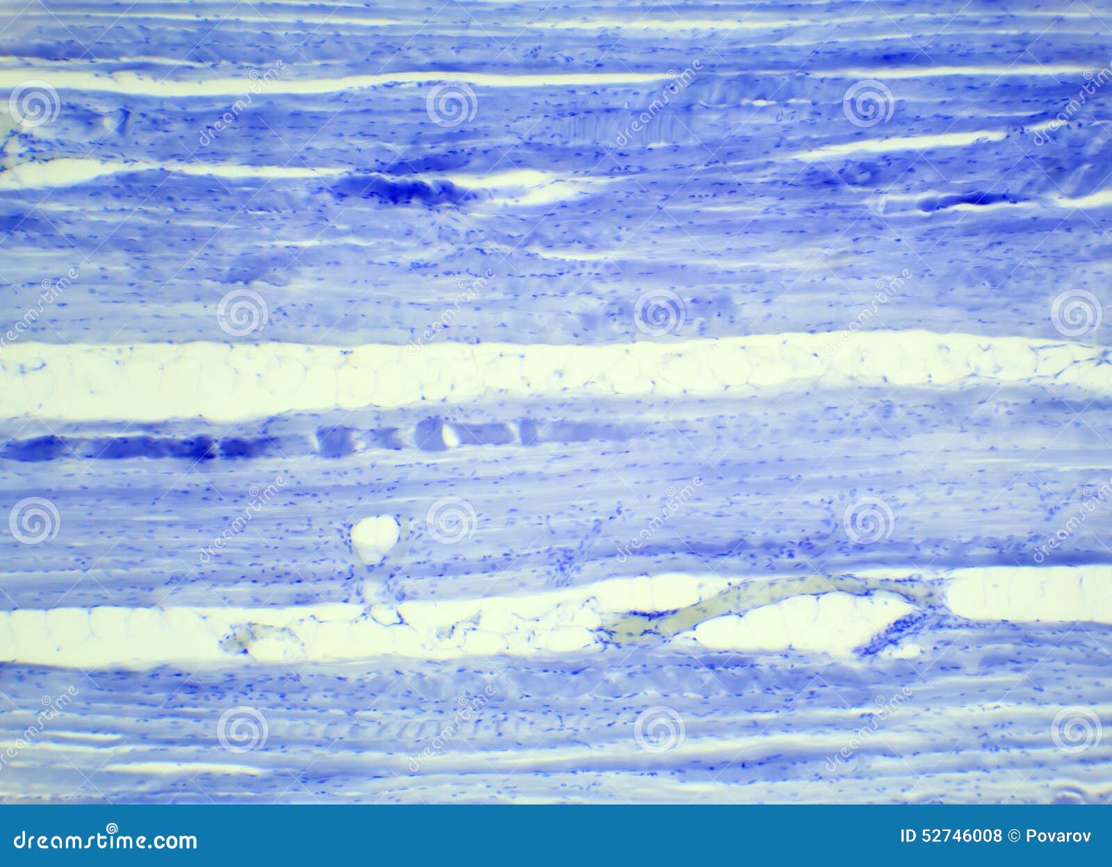 Skeletal Muscle Tissue Longitudinal Section Under a Microscope, Stock ...