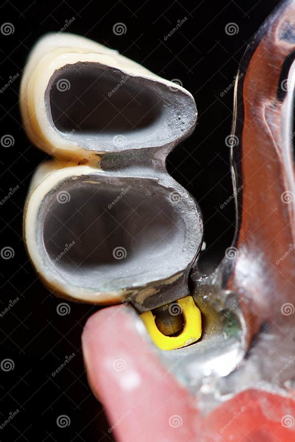 Skeletal prosthesis stock image. Image of mouth, denture - 28623733