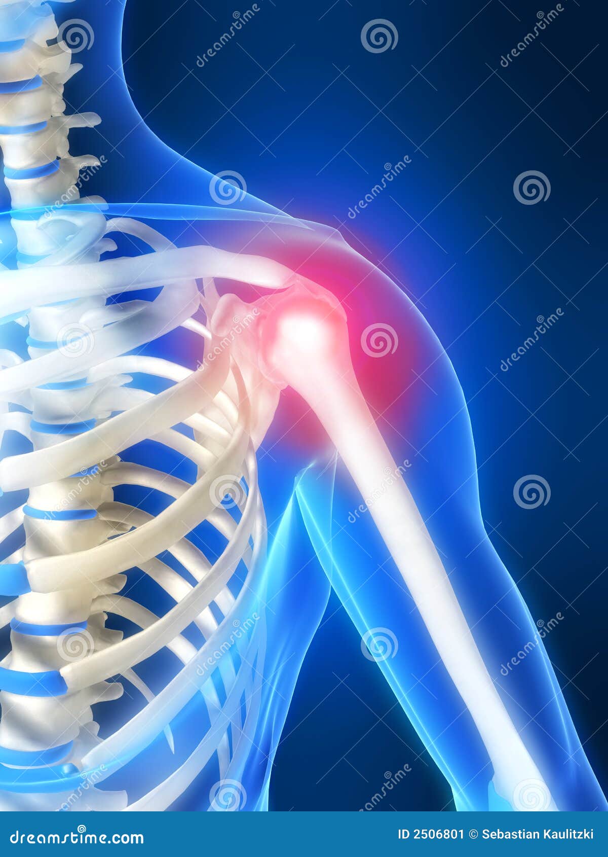 Skeletal Shoulder with Pain Stock Illustration - Illustration of ...