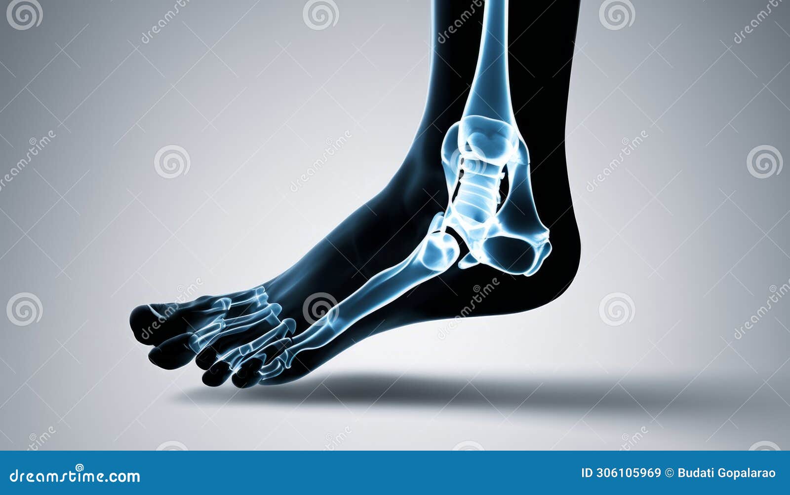 A Skeleton Foot with a Broken Bone Stock Illustration - Illustration of ...