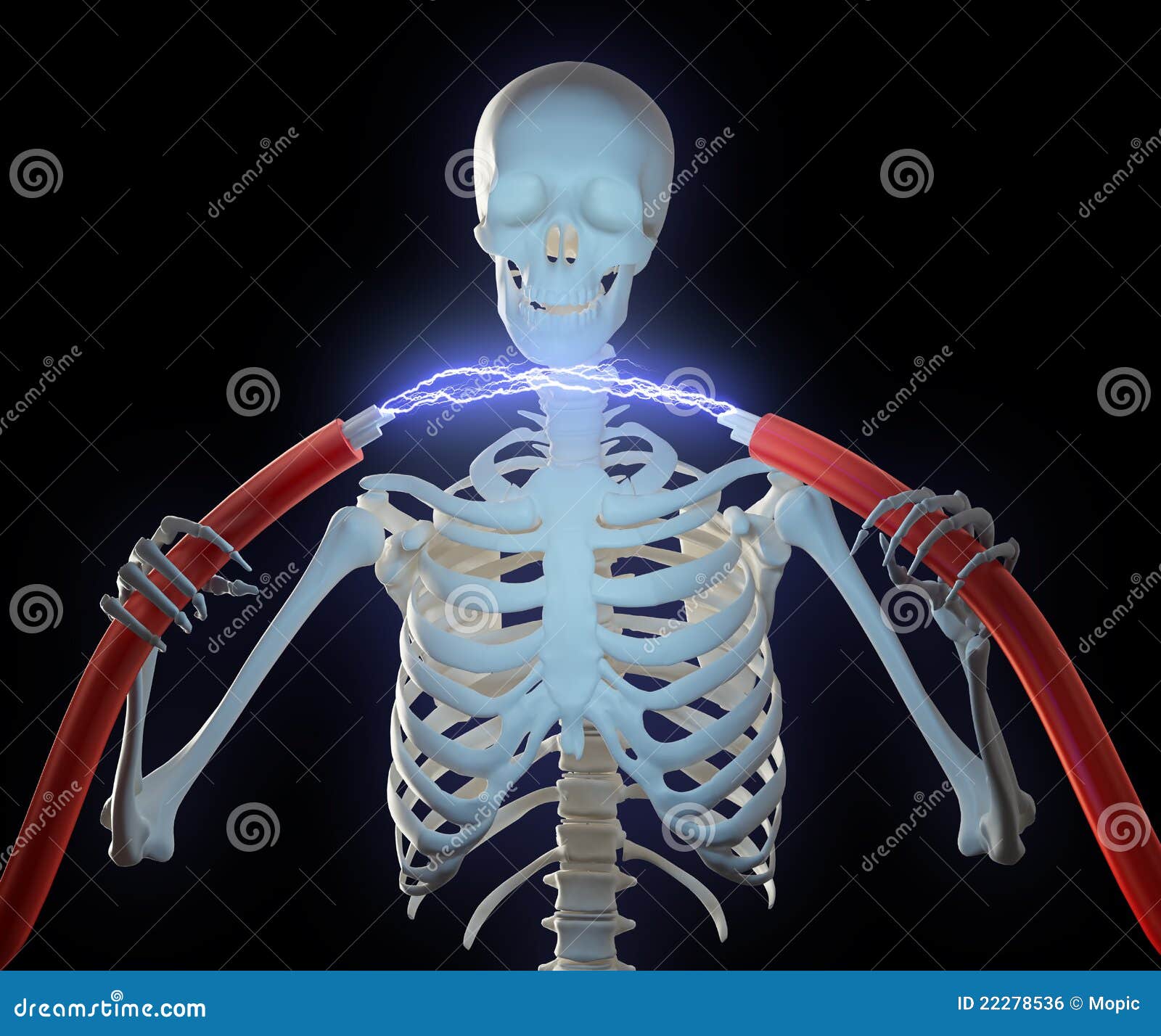 Skeleton Get Shock. Electric Shock. Human With A Skeleton Vector ...