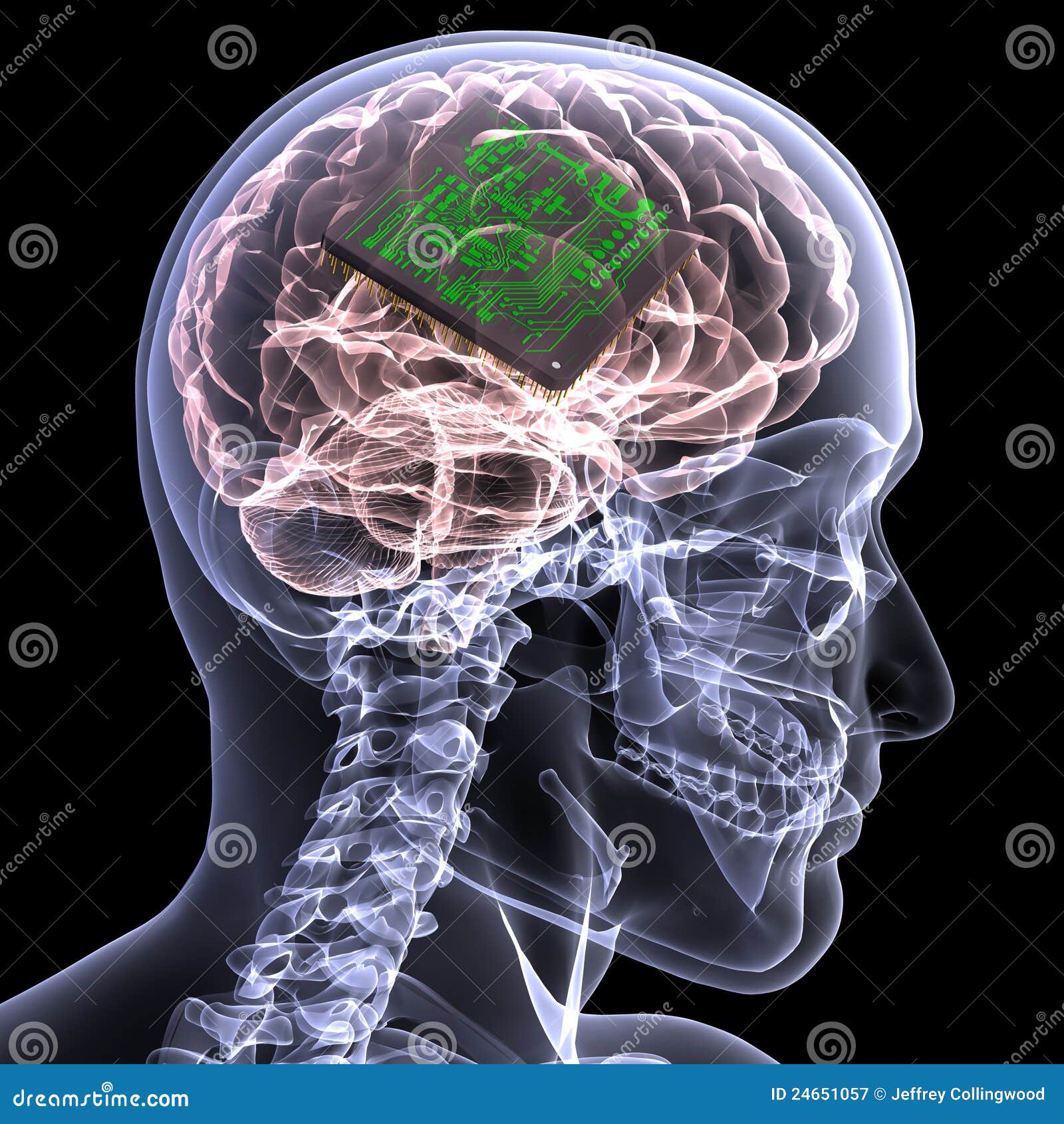 Skeleton X-Ray - Brain with CPU Stock Illustration - Illustration of ...
