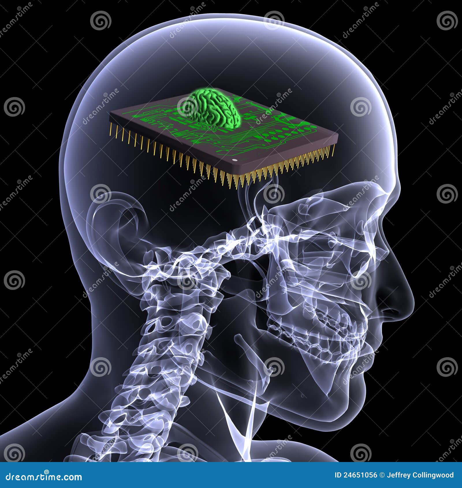 Skeleton X-Ray - CPU Brain stock illustration. Illustration of brain ...
