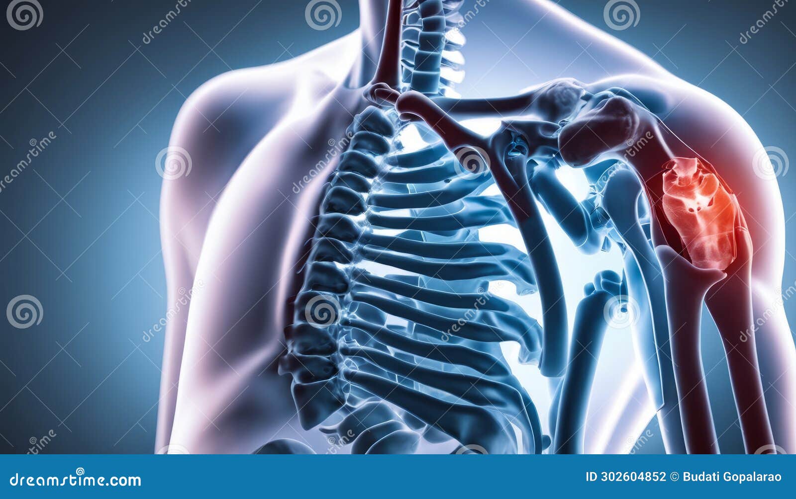 Shoulder Injury Illustration Cartoon Vector | CartoonDealer.com #275802217