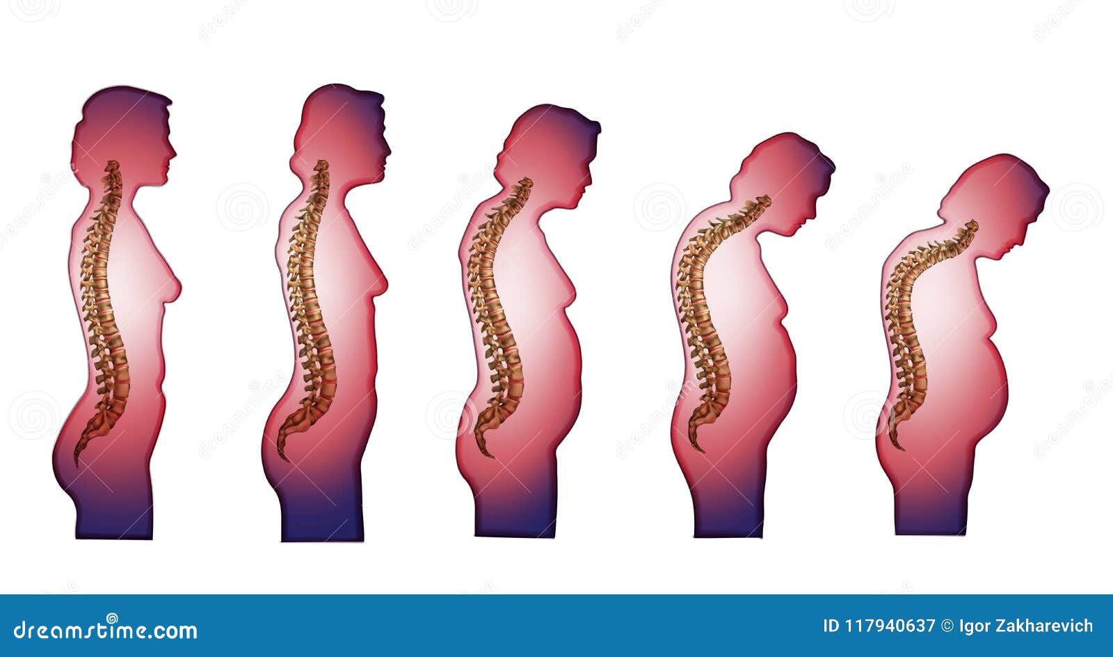 Skeleton_Spine Changing the Spine with Age Stock Illustration ...