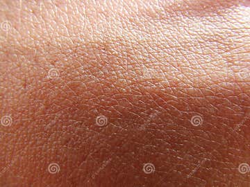 Skin stock photo. Image of medical, body, texture, detail - 1086722