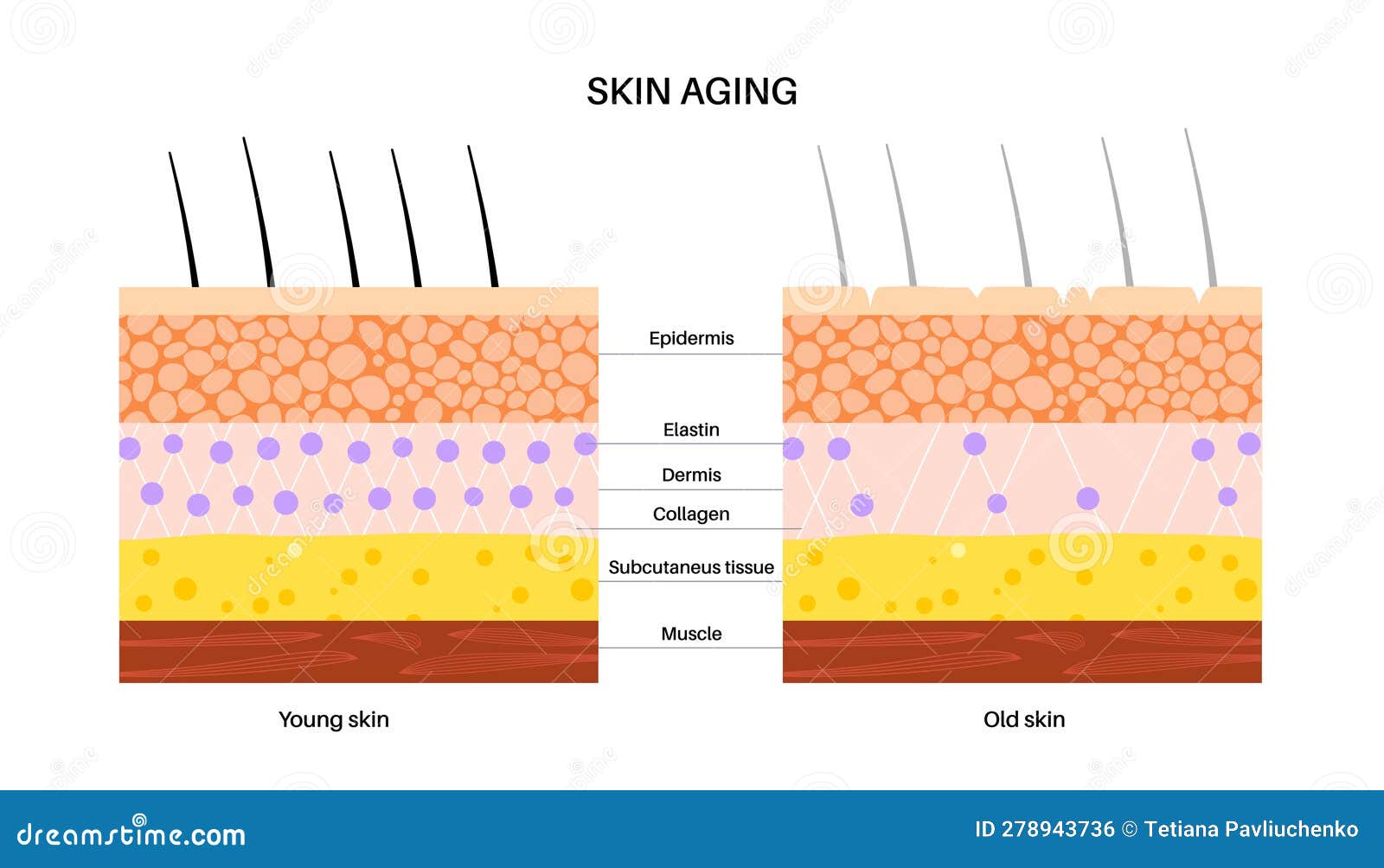 Skin aging poster stock vector. Illustration of care - 278943736